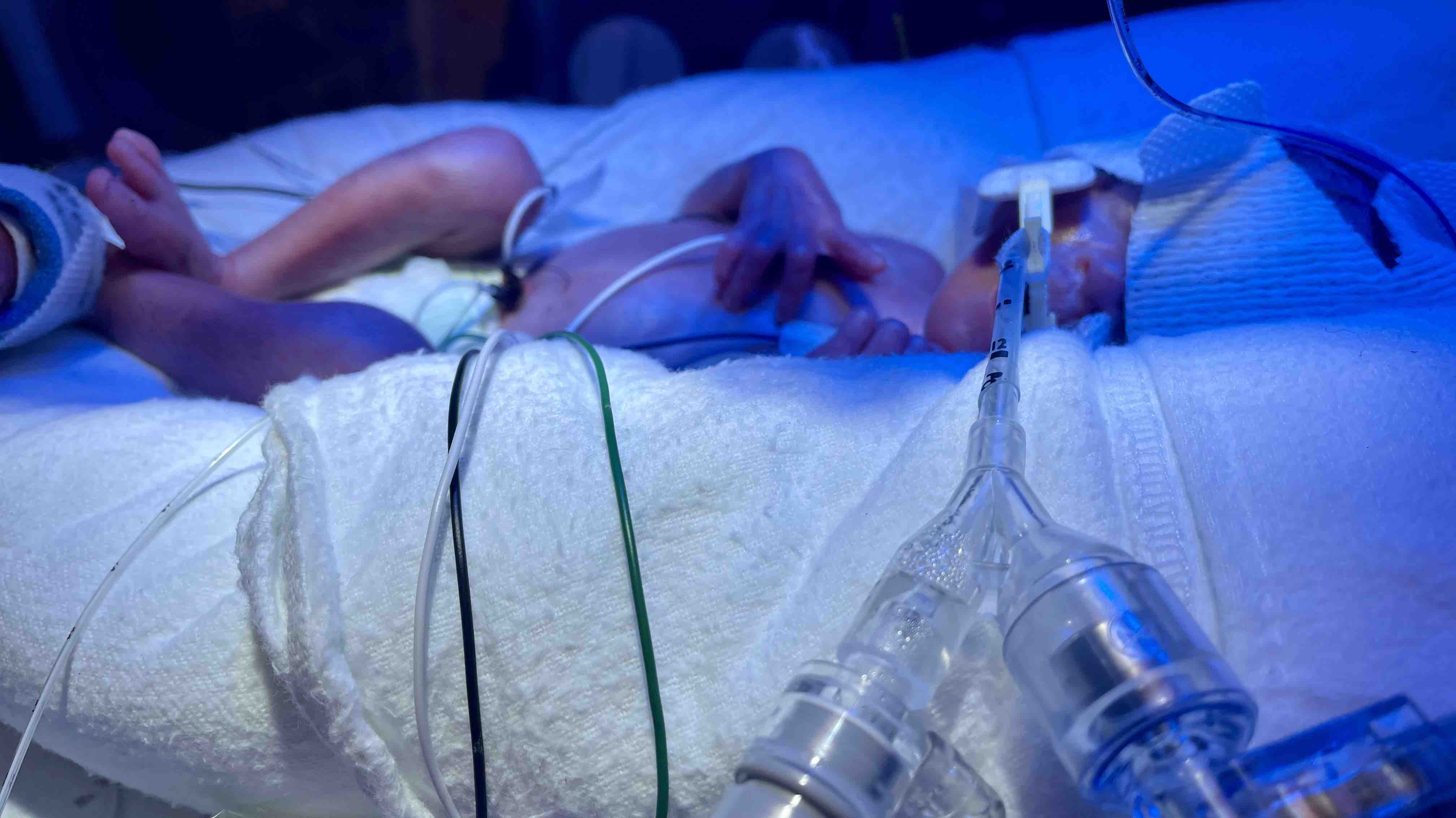 Fundraiser for Forrest Mckay by Meghan Yvette Boulanger : Welcoming ...