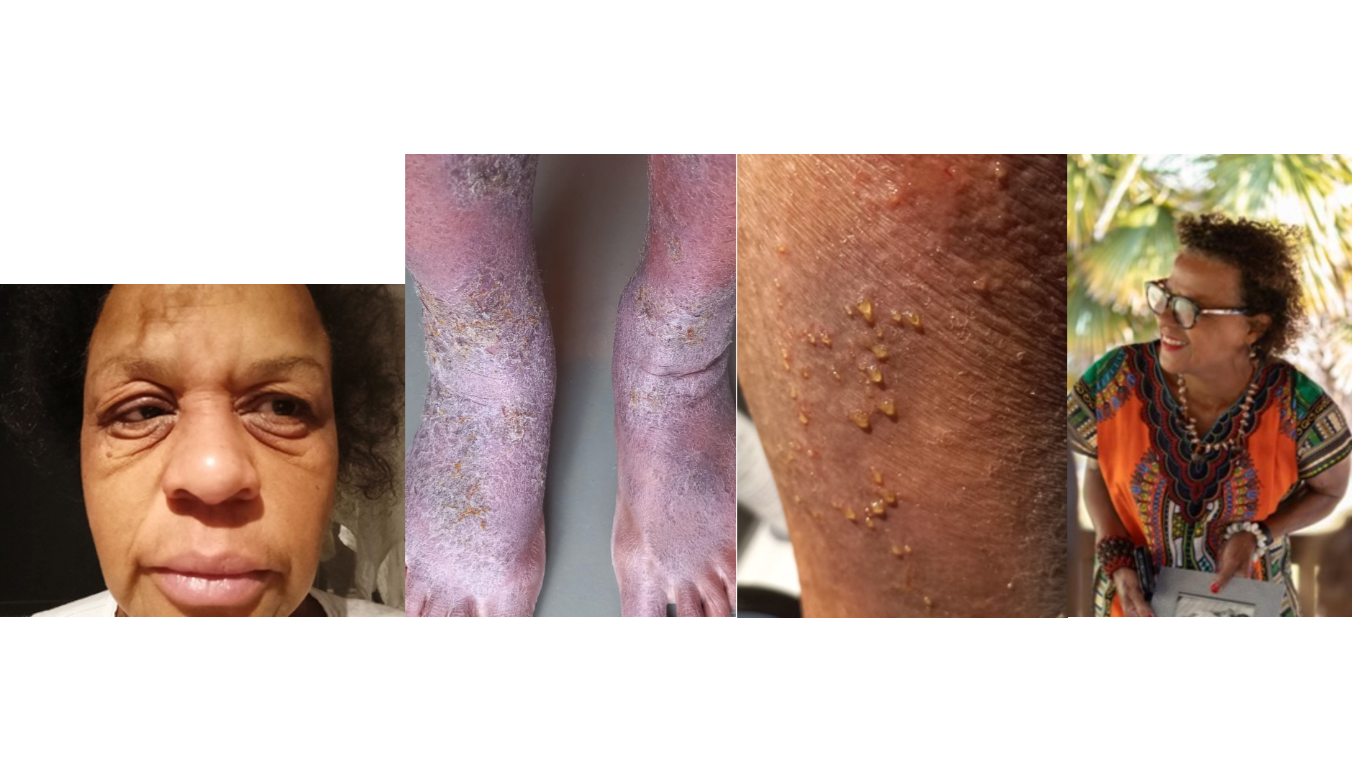 Fundraiser by Anne, Eva, Inge Linda, Margit en Ingrid Jansen : Help ...