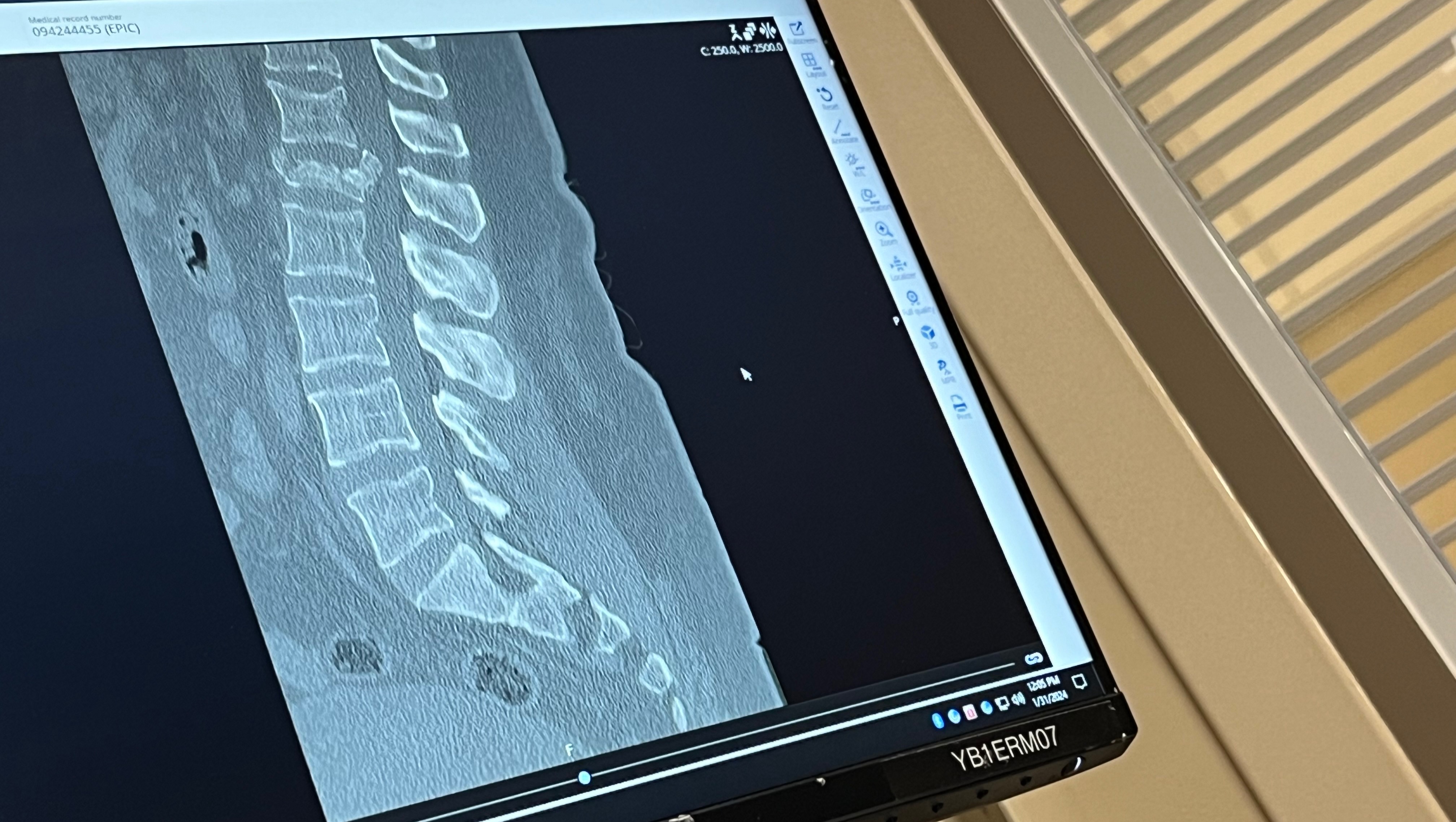 Fundraiser by Serena Craft : Struggling with the end