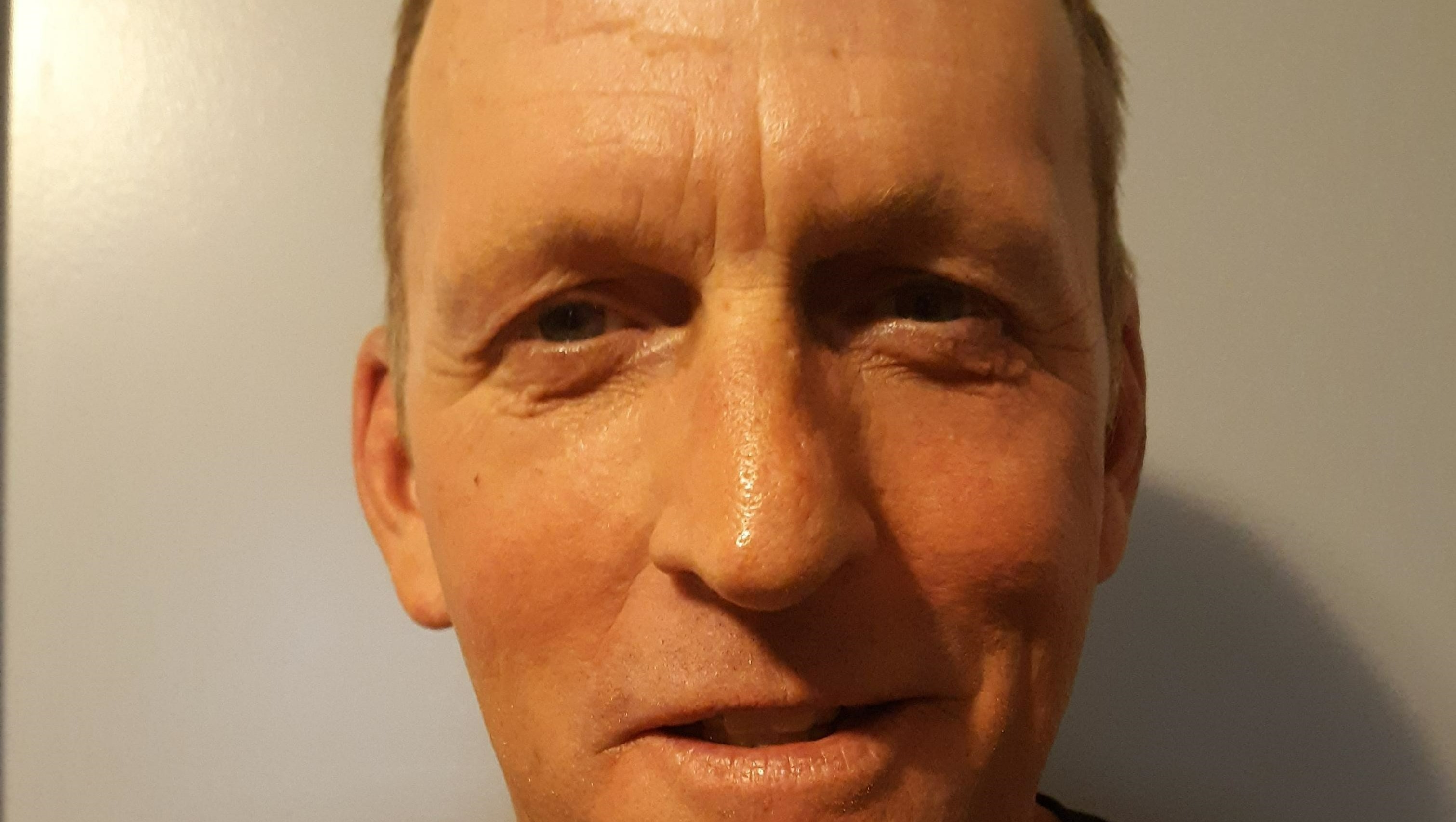 Fundraiser for Christopher Eiting by Richard Manning : Chris Eiting