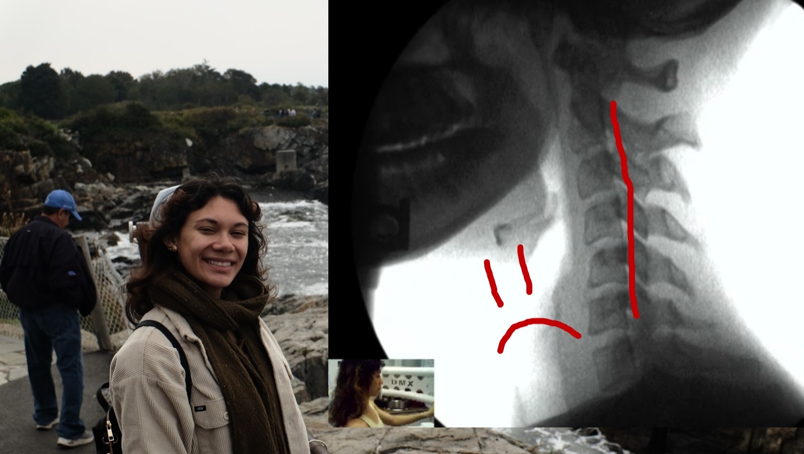 Fundraiser by Emily Barragan : Help Emily Treat Her Neck Ligaments ...