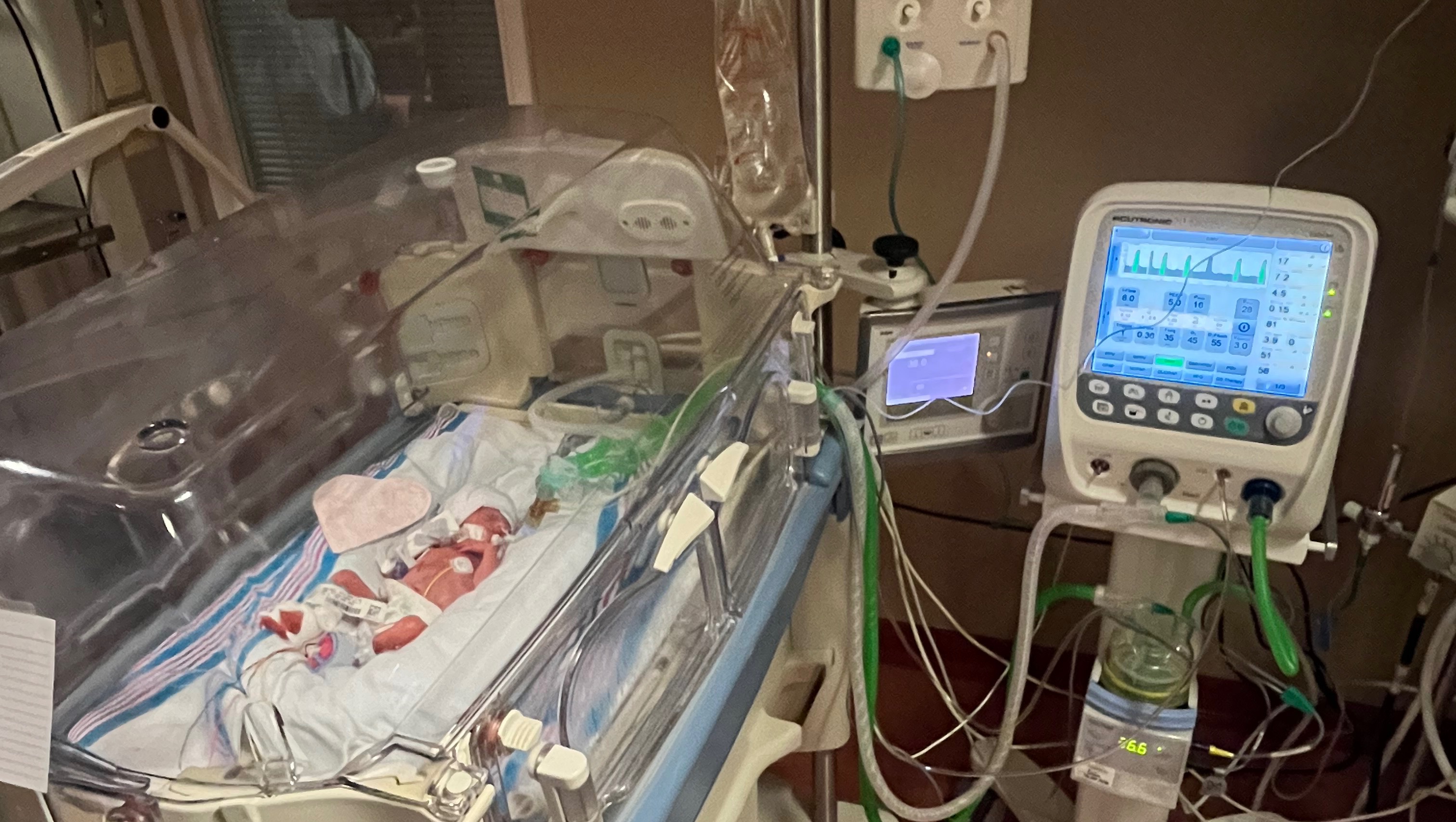 Fundraiser by Eva Williams : RPH Neonatal Intensive Care Unit (NICU ...