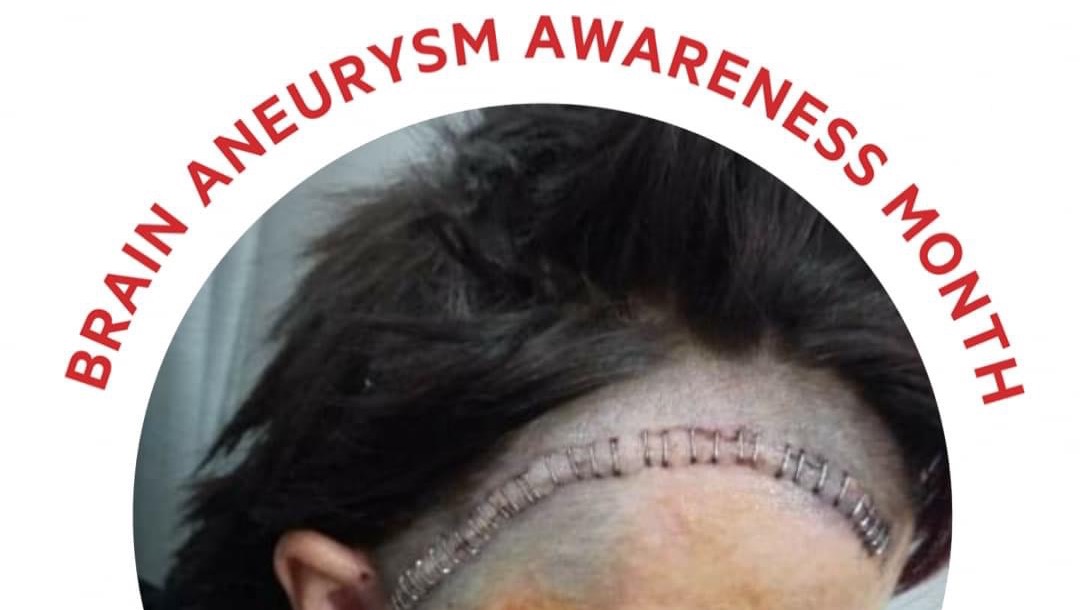 Fundraiser for Sarah-Jane Cook by Tyla Pyke : ROUND 2 - Brain Surgery ...