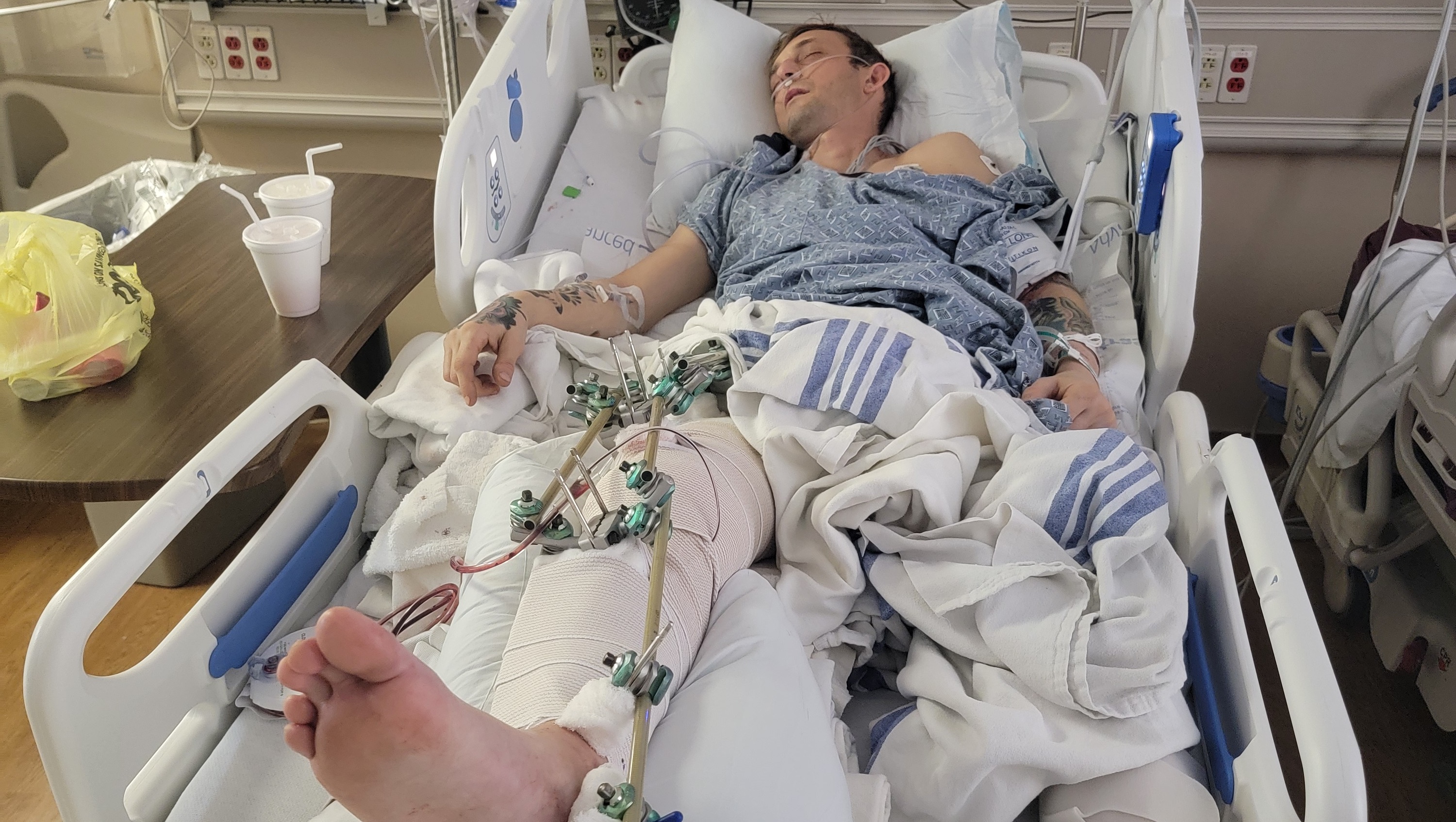 Fundraiser by Elizabeth Goetzman : Chris’s road to recovery after ...