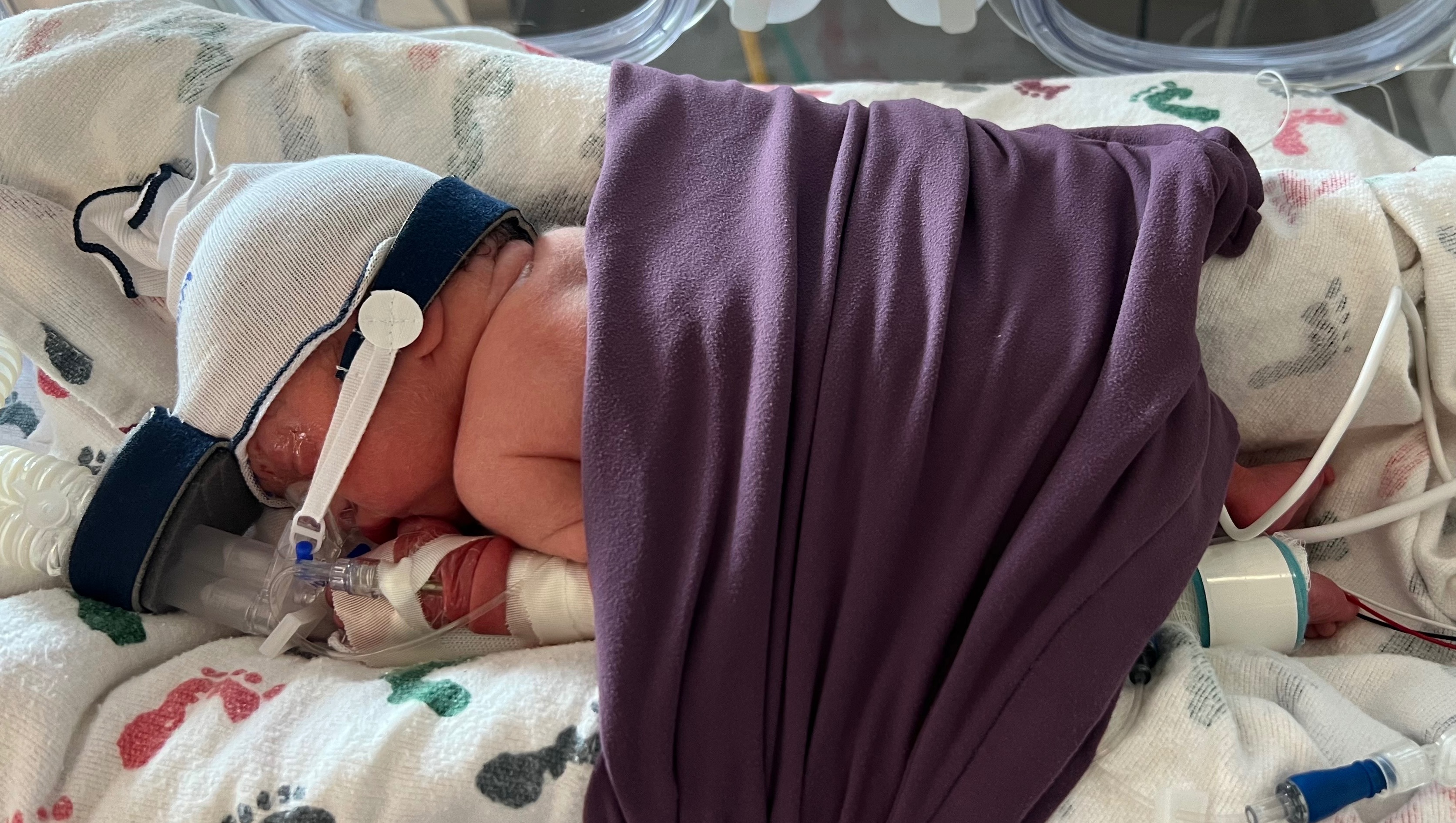 Fundraiser for Anna Tardy by Bailey Tardy : Help for Karlsson Family ...