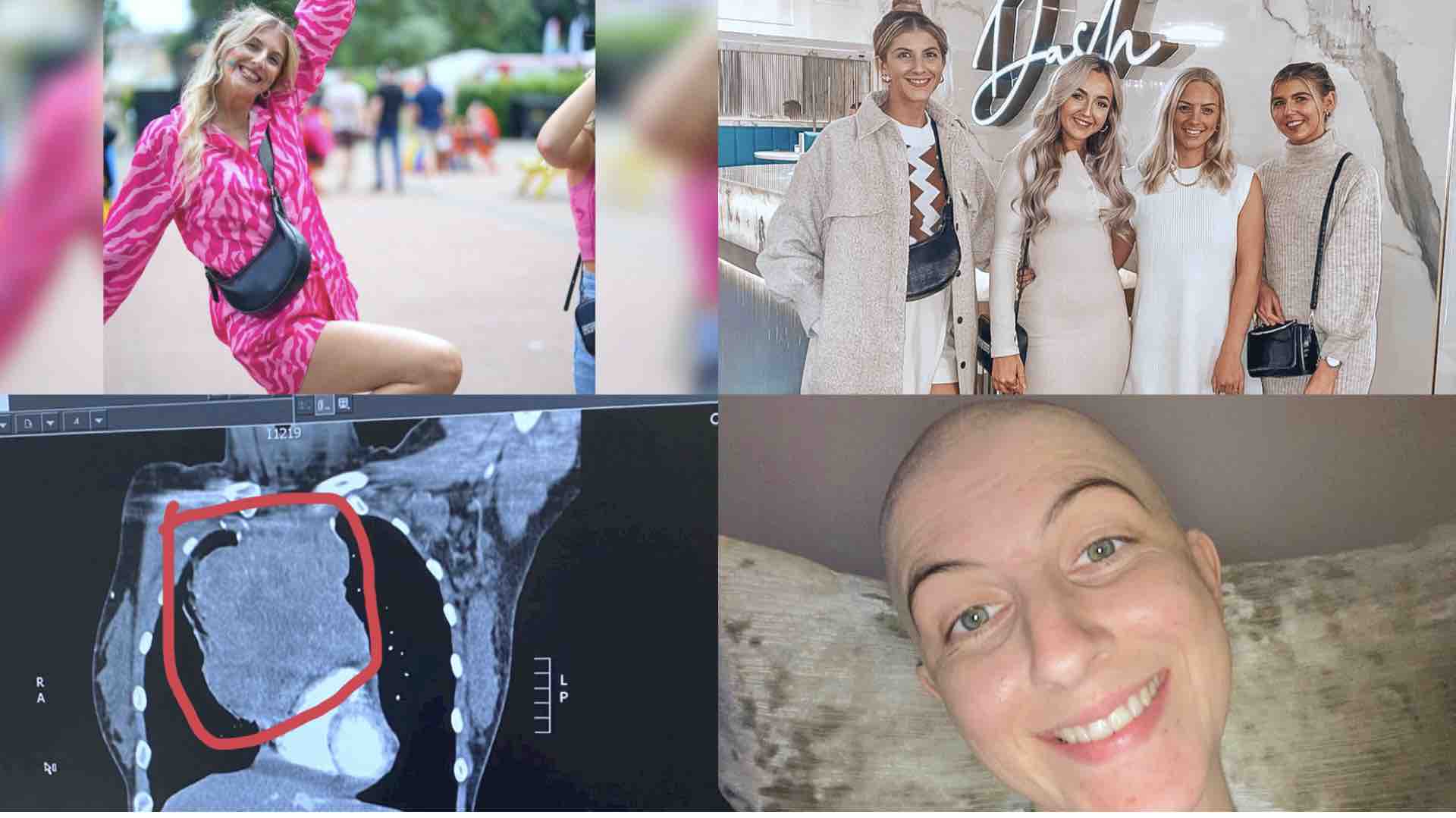 Fundraiser for Abbie Raven by Charlotte Bowden : Help our friend whilst ...
