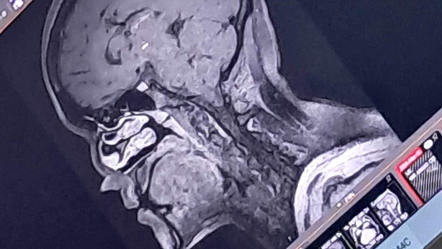 Fundraiser for beth Jacobson by Chevy Jacobson : Time to help Beth