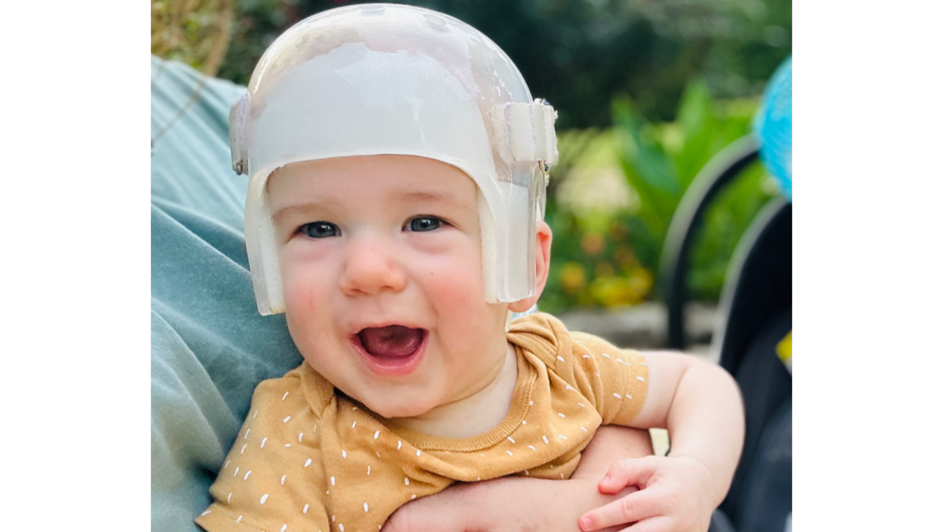 Fundraiser for Chynna Watson by Haley Clark : Myles' Surgery for ...