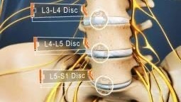 Fundraiser by Damon Izzy : Medical procedure for debilitating back injury.