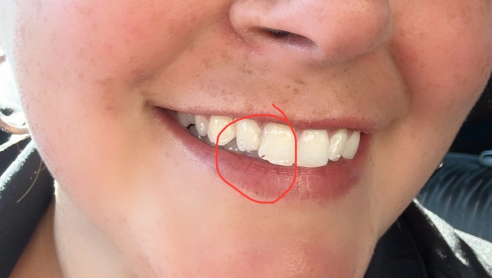 Fundraiser by Amanda Branham : Save My Smile