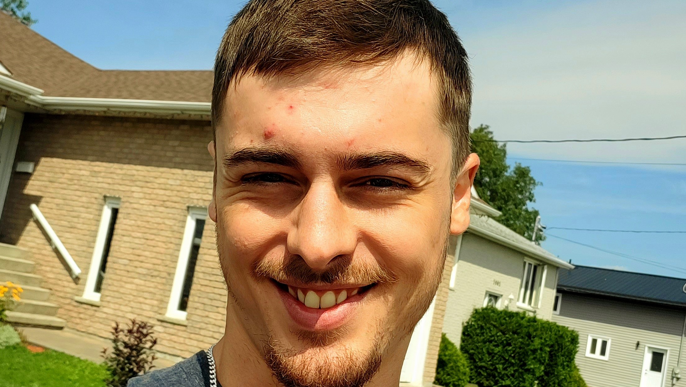 Fundraiser by James Sitko : Support Jimmy's Trip to London for Brain ...