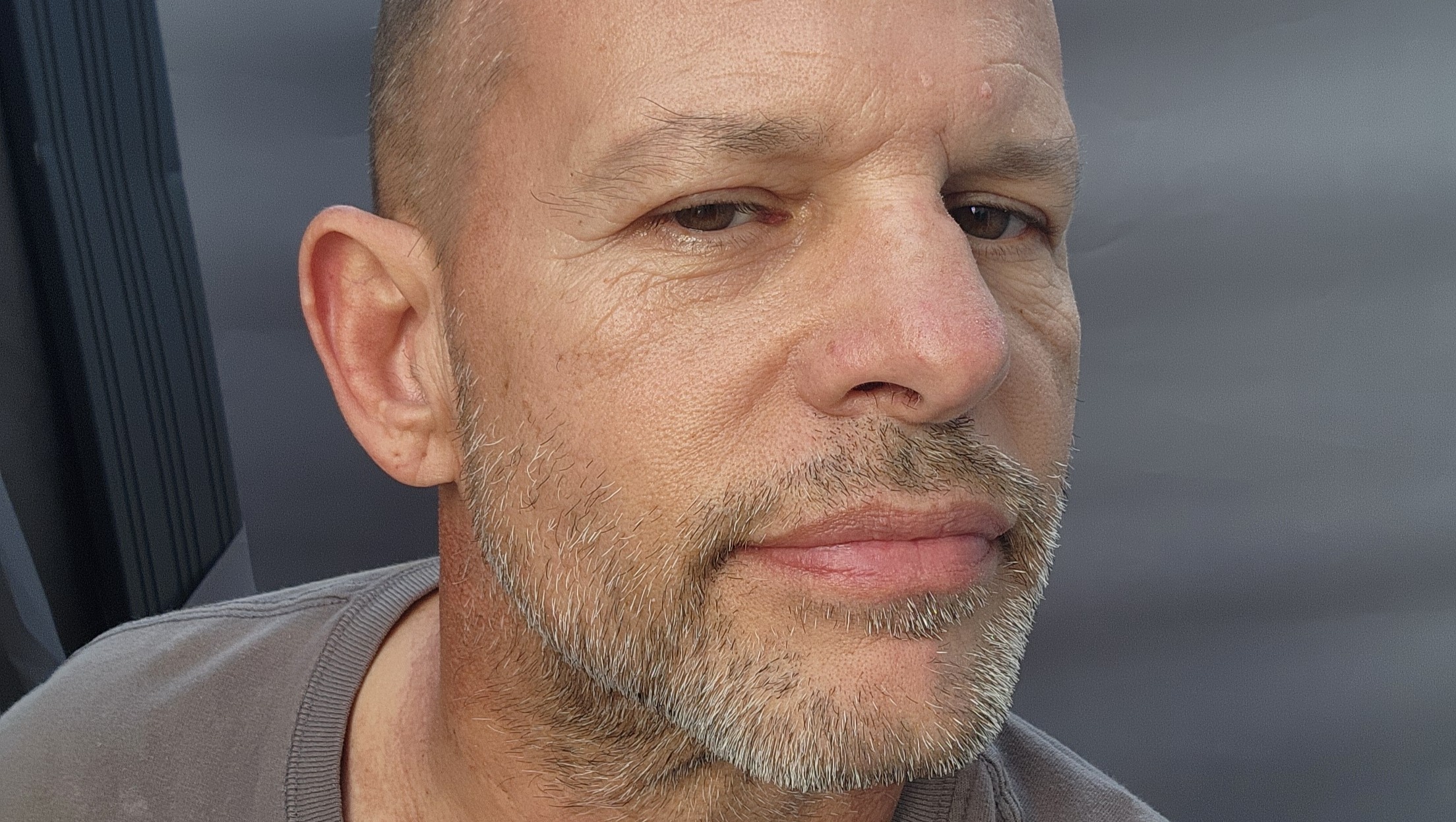 Fundraiser by Larry Paul Williams Jr : Chicago Nerve Regeneration trial