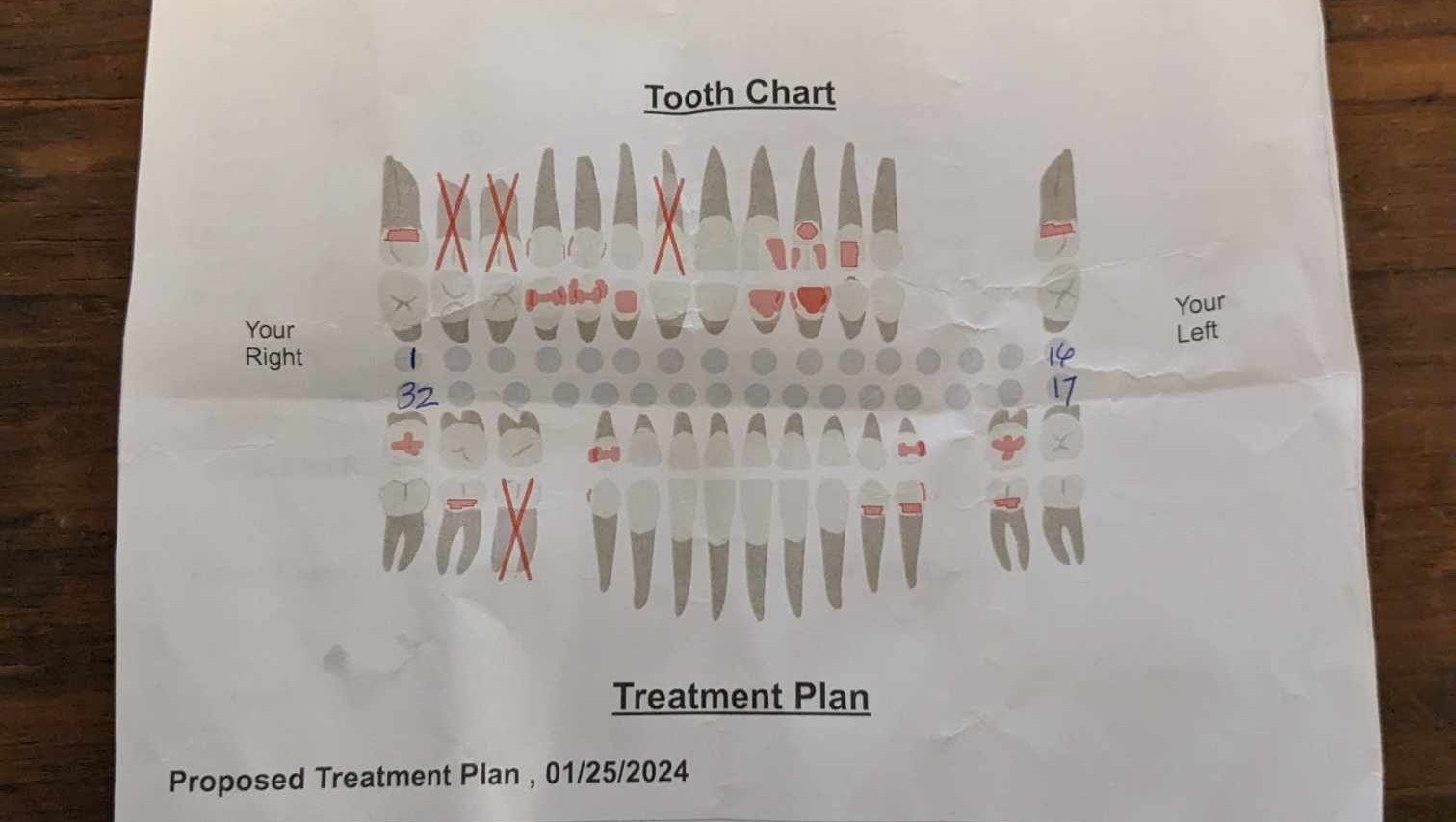 Fundraiser by Thomas Weatherwax : Help Fix Thomas' Teeth