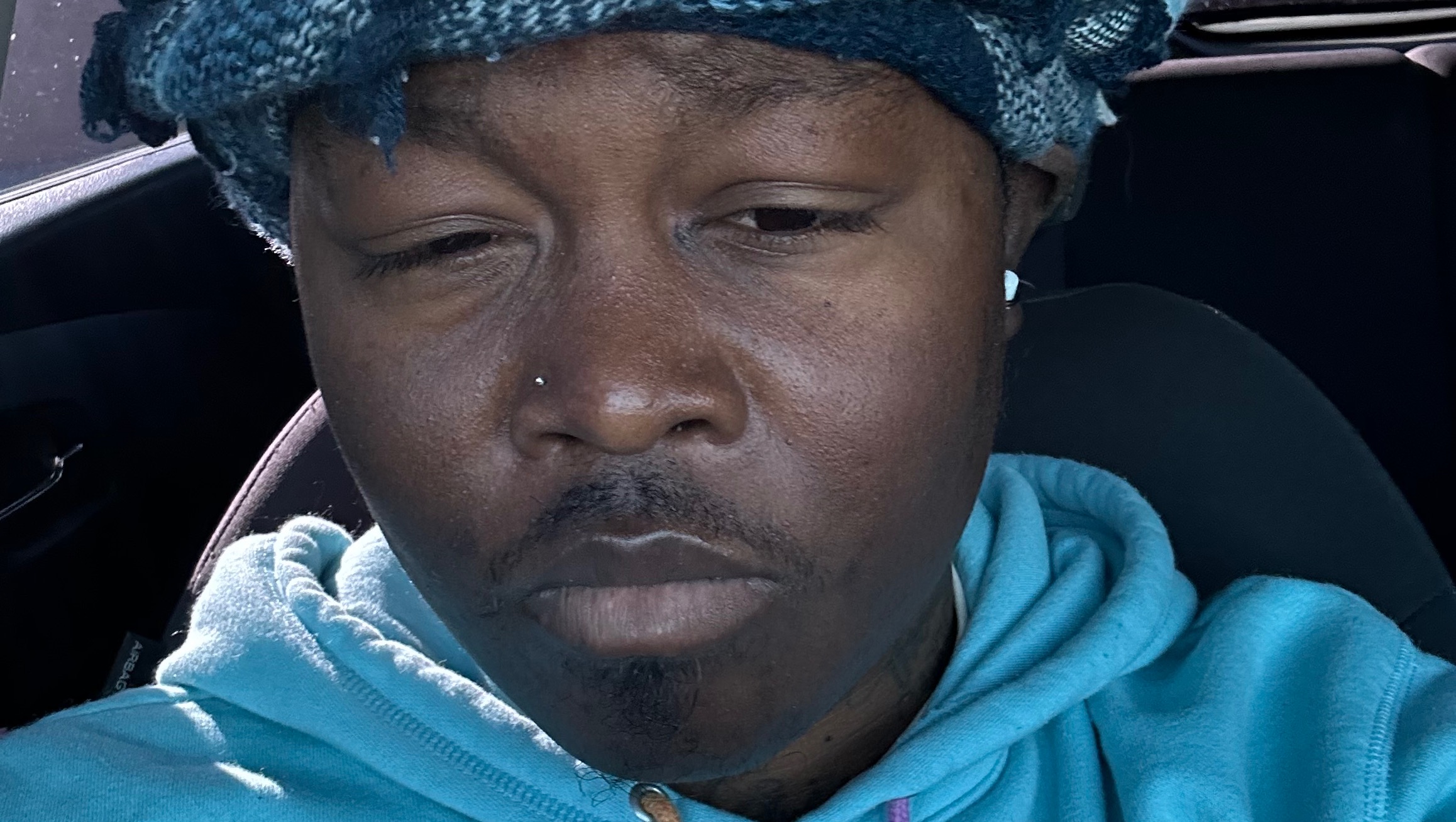 Fundraiser by Harvey Bridges : Help Get a Double Transplant and Achieve Dreams!