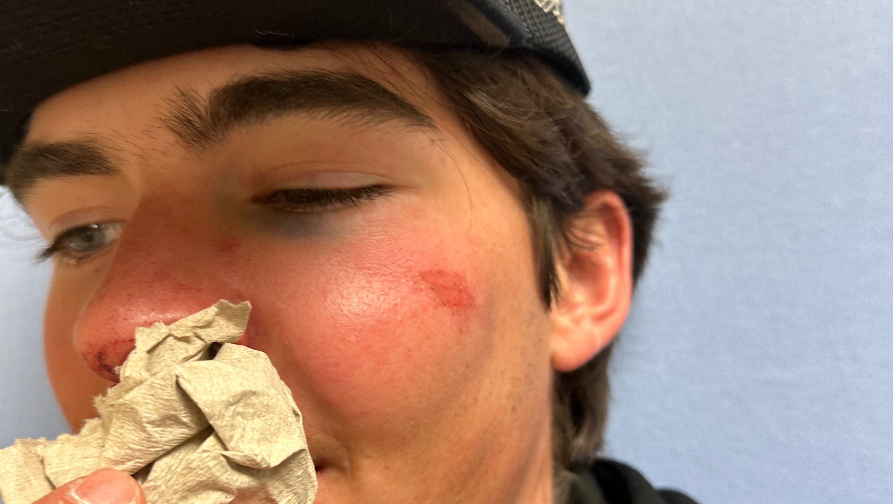 Fundraiser by Jennifer Willis : Tanner Willis Surgery