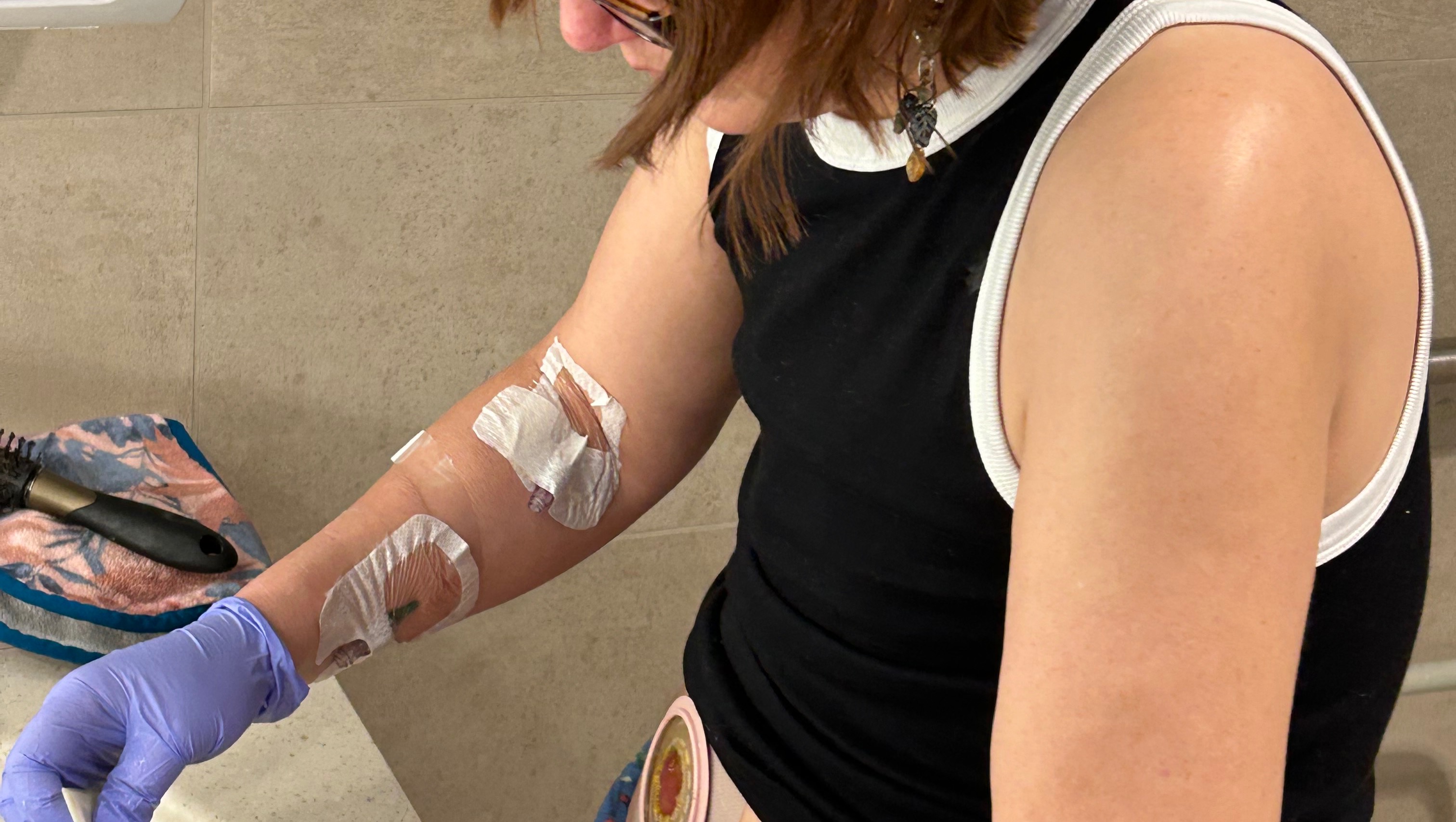 Fundraiser by Martin Bargeron : Jenn’s Colectomy Ileostomy Recovery Fund