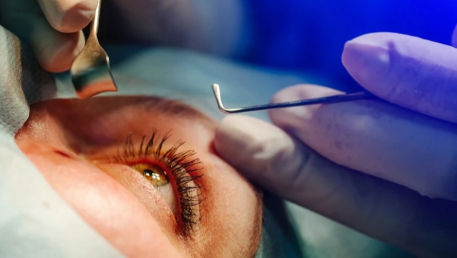 Fundraiser by Christopher Skelley : Emergency eye surgery