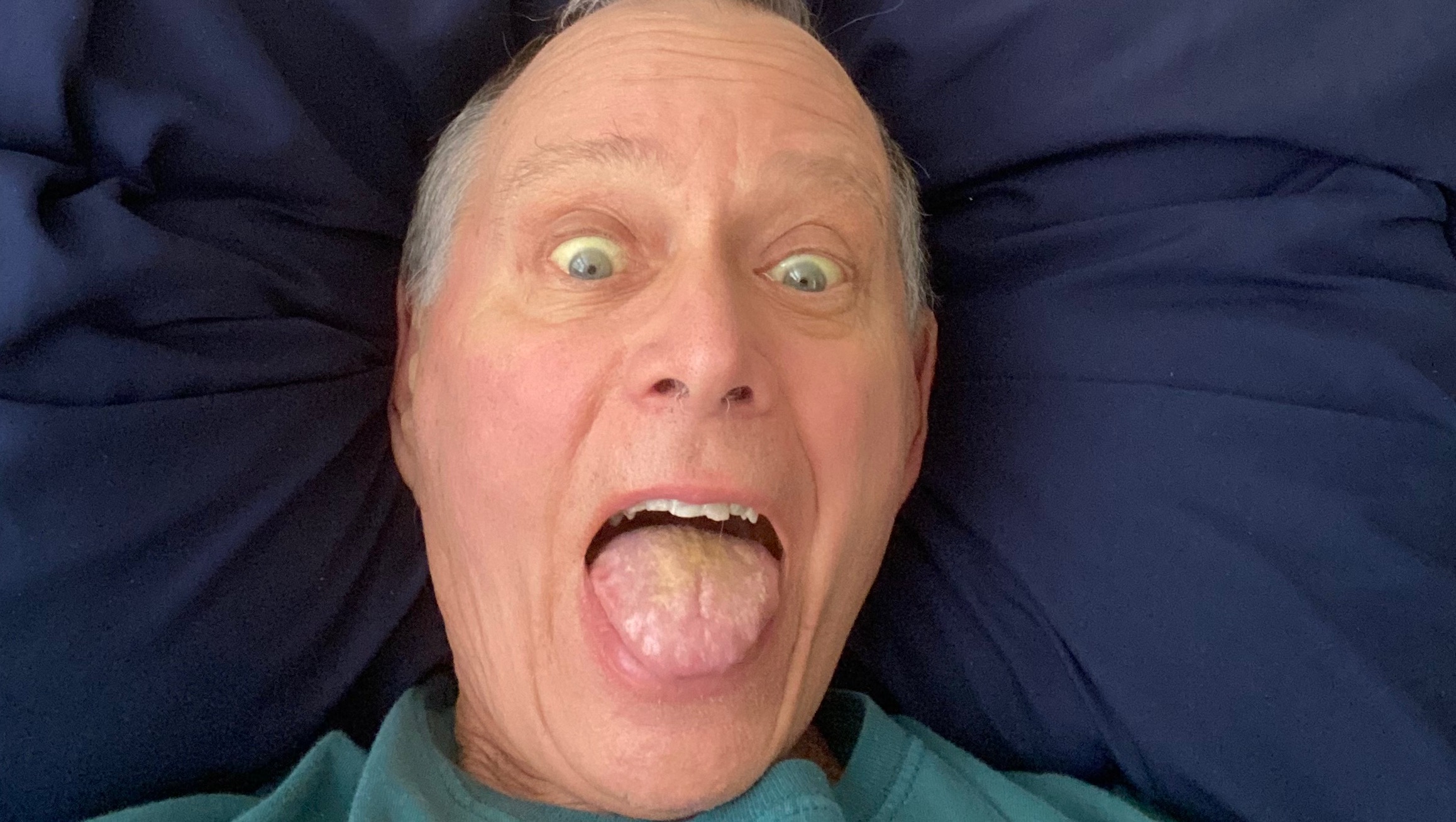 Fundraiser by Paul Popadak : I have very high “out of pocket” on my ...