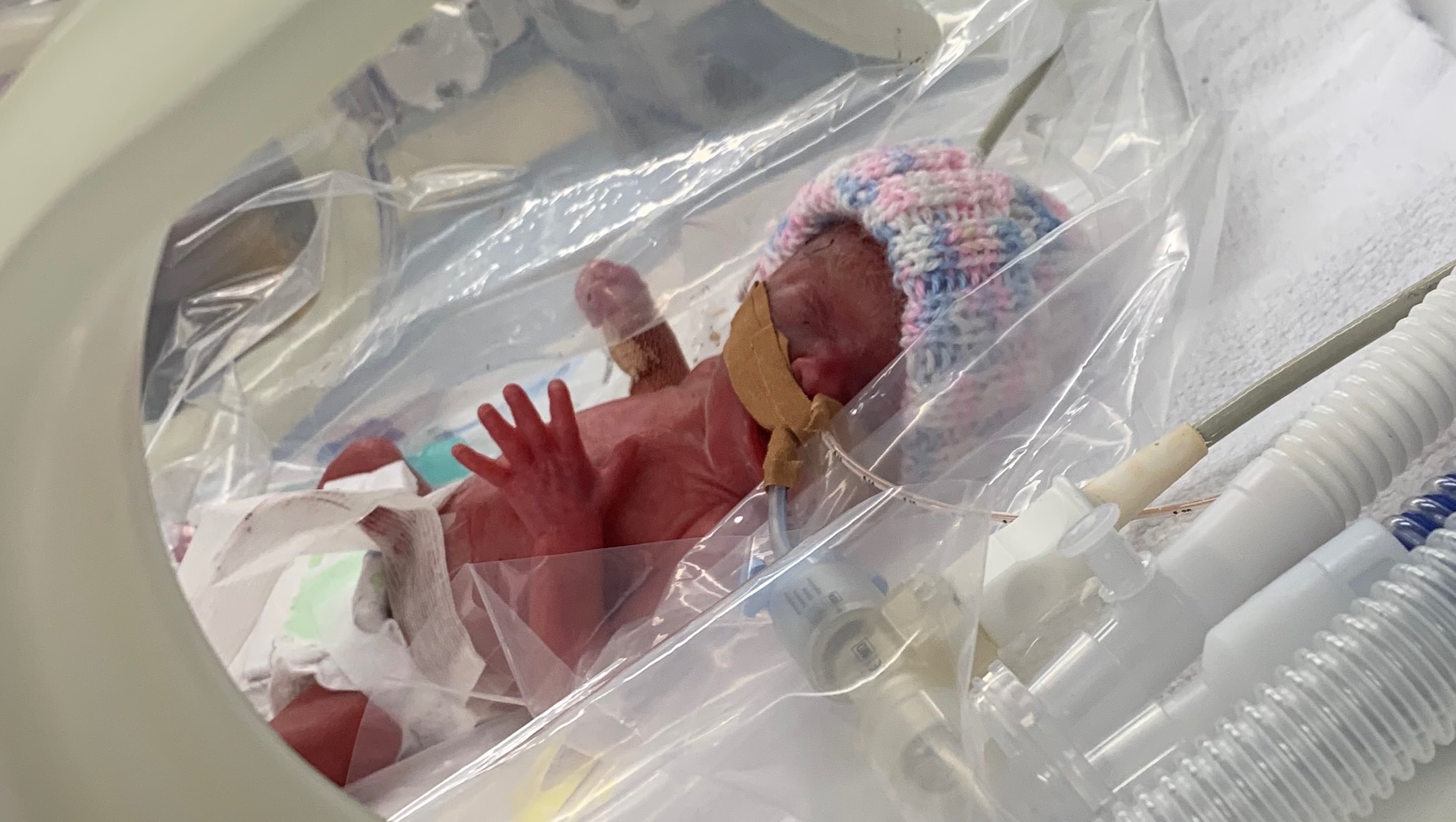 Fundraiser by Ben Evans : Support Stevi-Joy McCall - Born prematurely ...