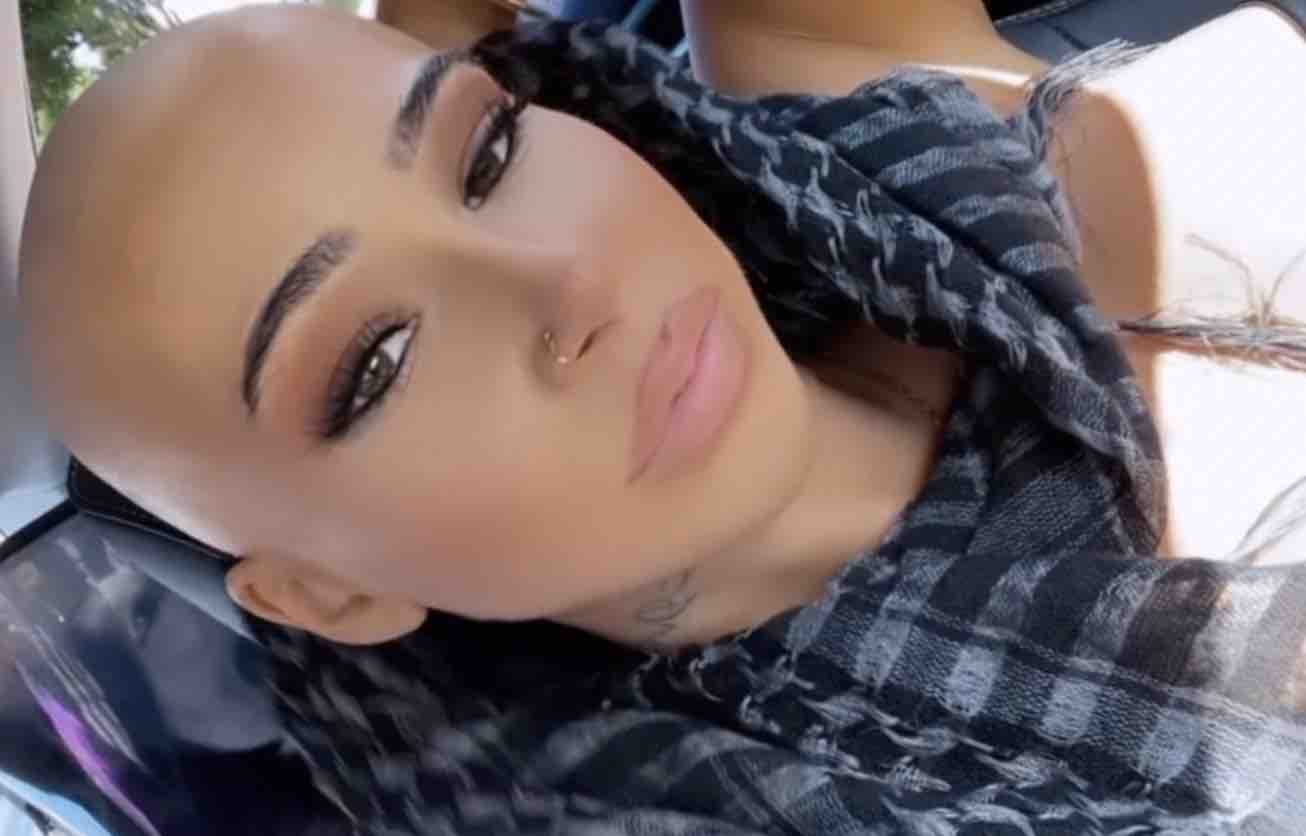 Fundraiser by Dev Hicks : Devyn’s Alopecia Journey