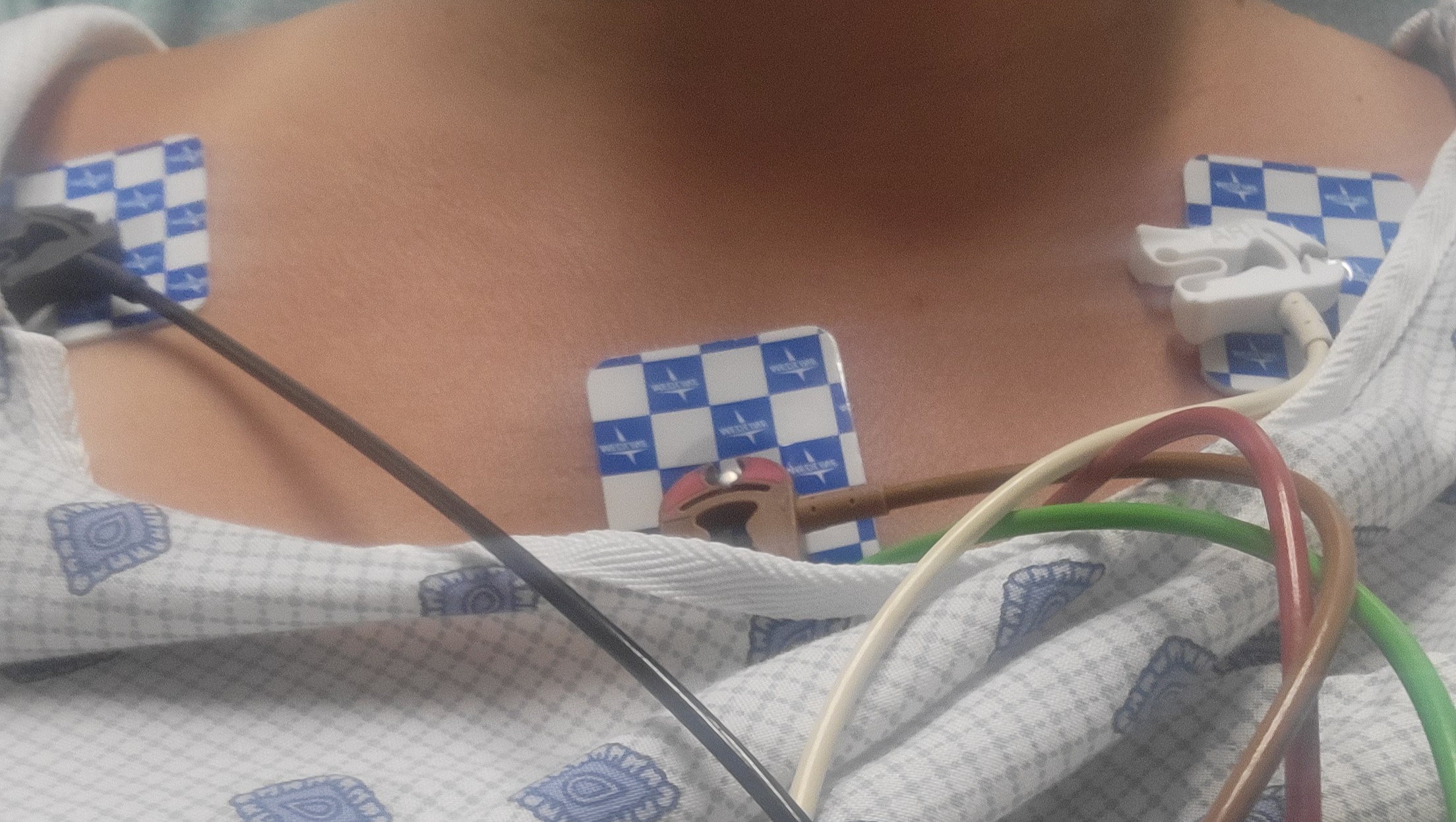 Fundraiser by Ashley Lopez : SVT HEART SURGERY