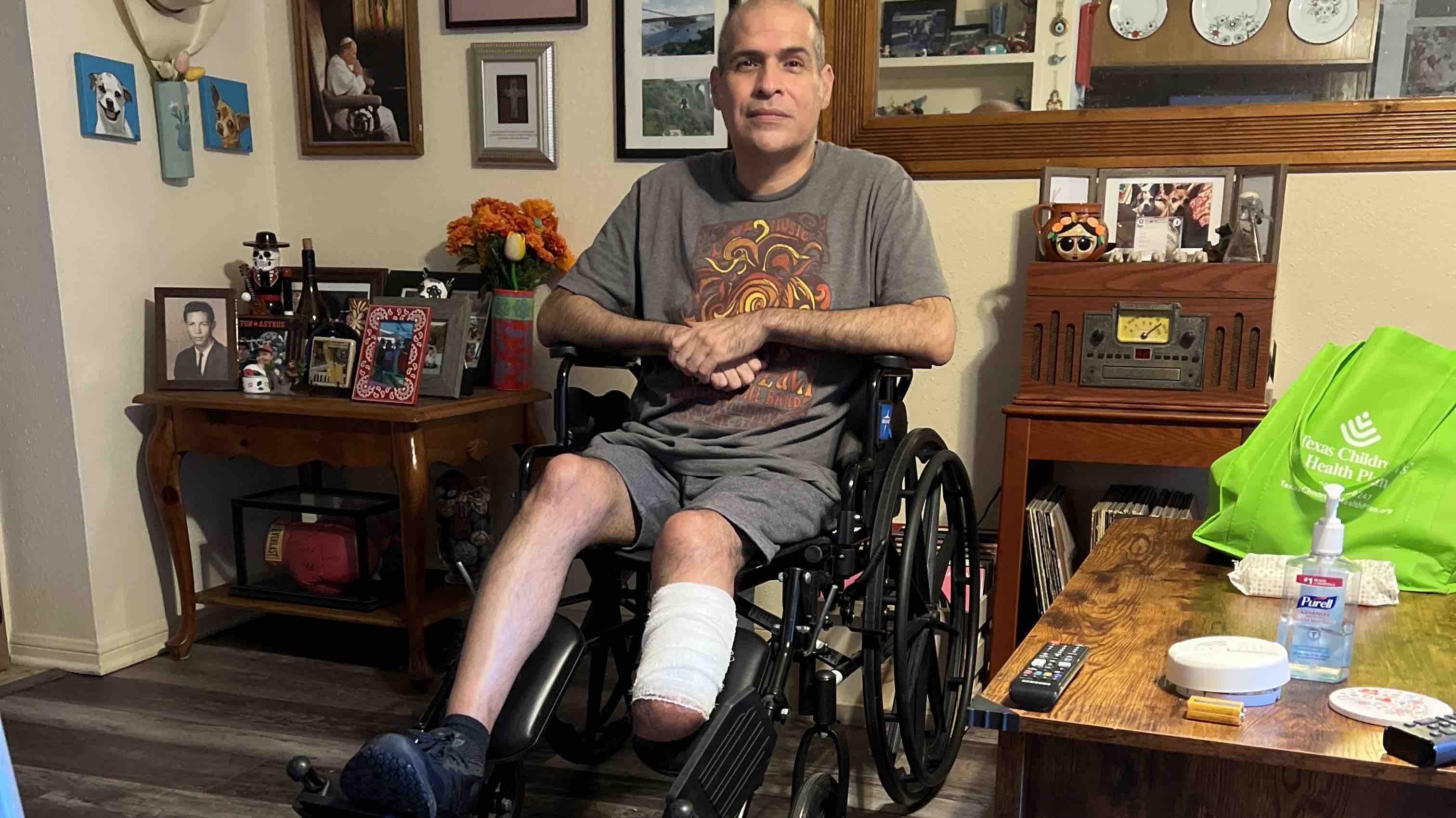 Fundraiser by CHRISTOPHER MARTINEZ : PROSTHETIC LEG AND MEDICAL BILLS ...