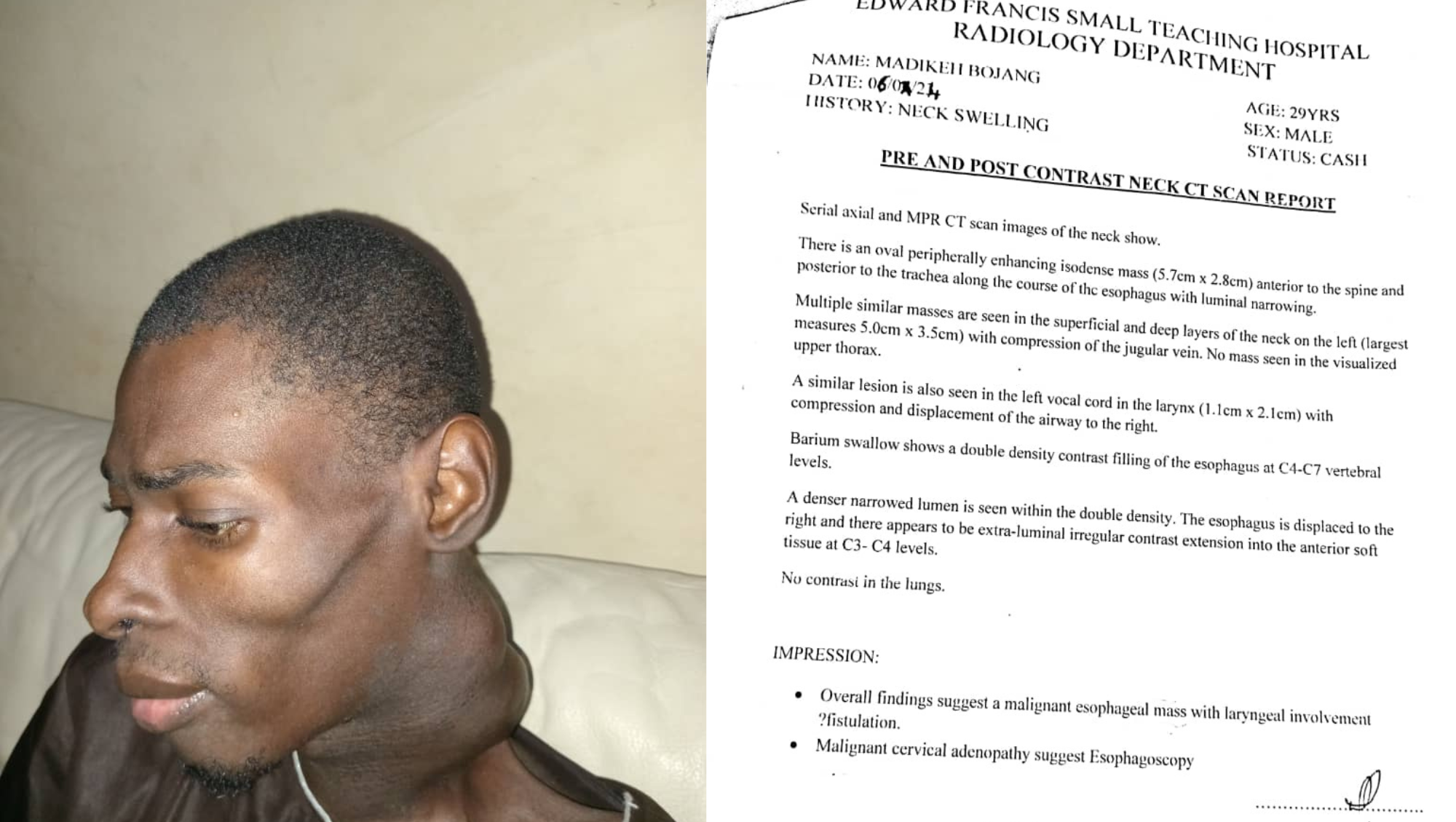 Fundraiser by Ebrima Senghor : Madikeh Bojang in urgent need of medical ...
