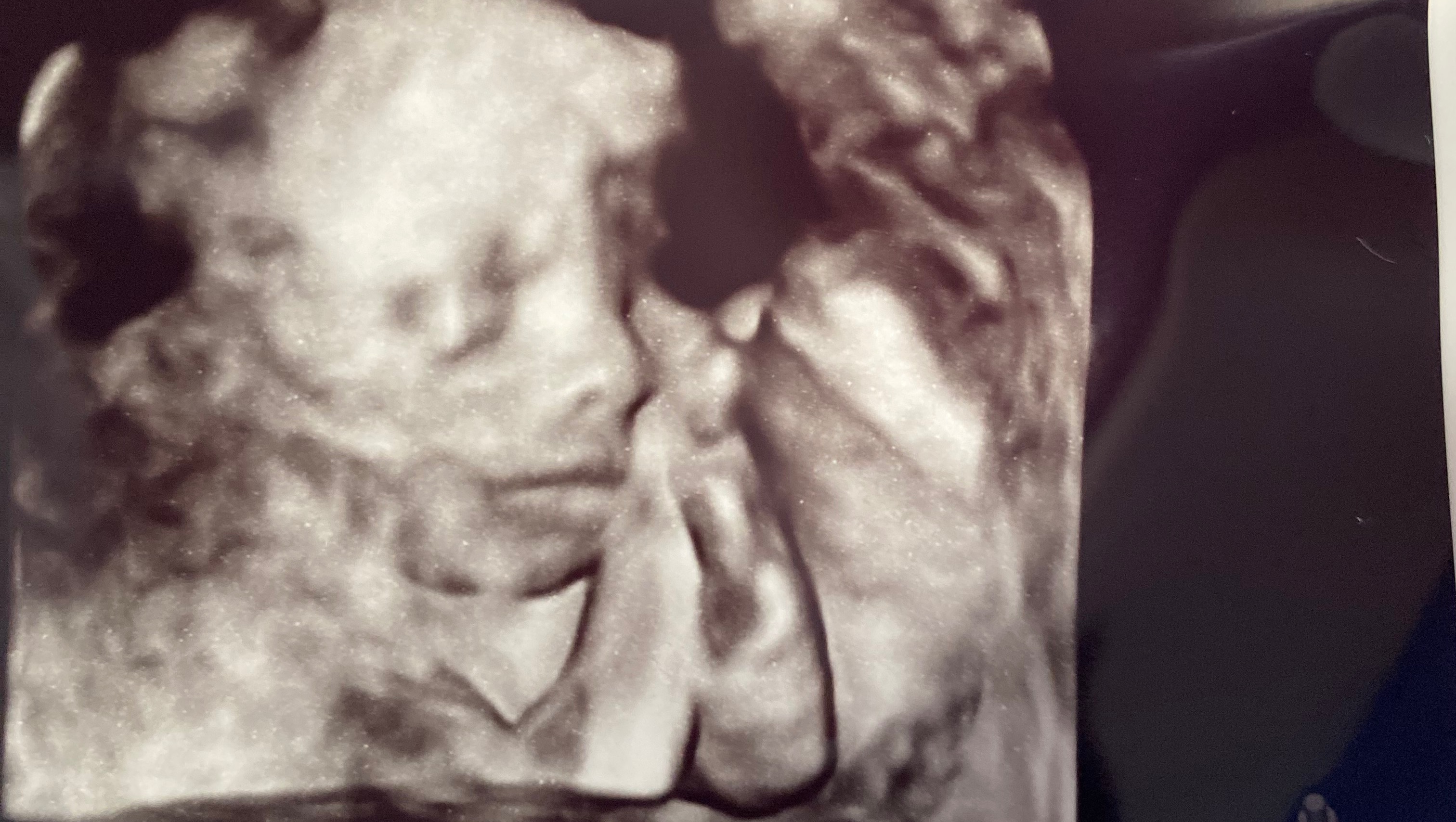 Fundraiser by Kali Gibbons : A midwife also money for diapers and baby ...