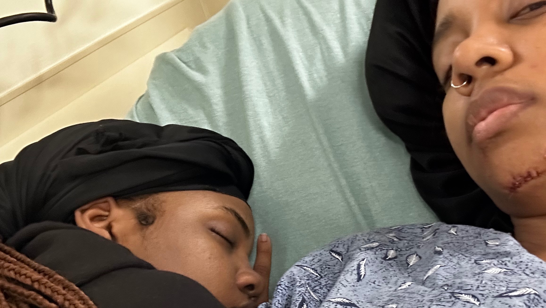 Fundraiser by Michelle Biggs : Brain surgery & recovery