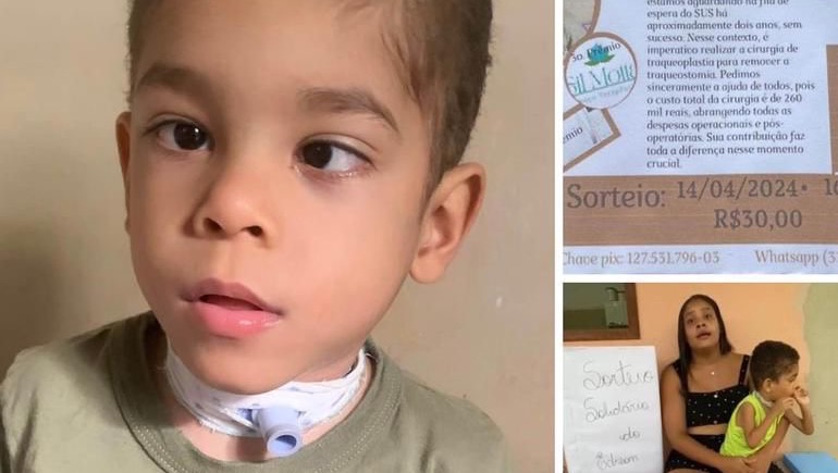 Fundraiser by Anabela C : Helping 2yr old Edson Fernando surgery