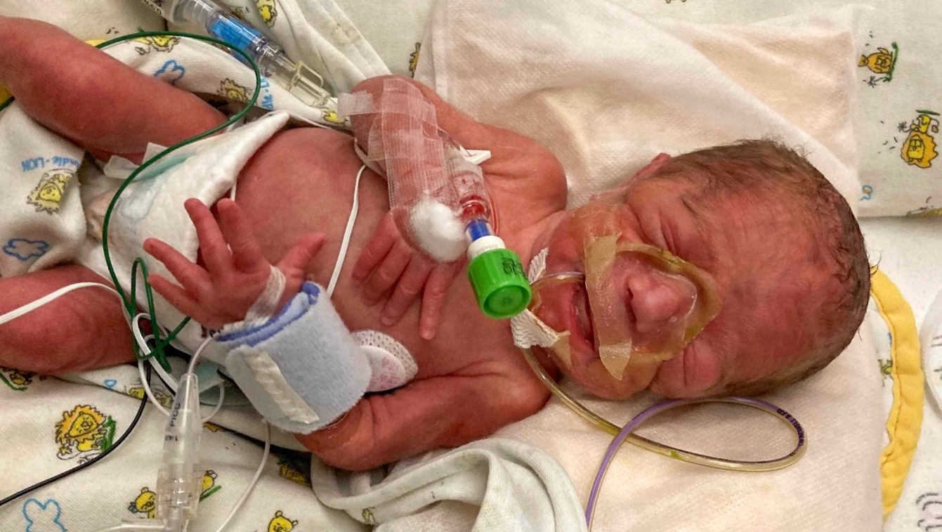 Fundraiser for Kayla Strehlow by Allie Hanson : Ellee James Strehlow