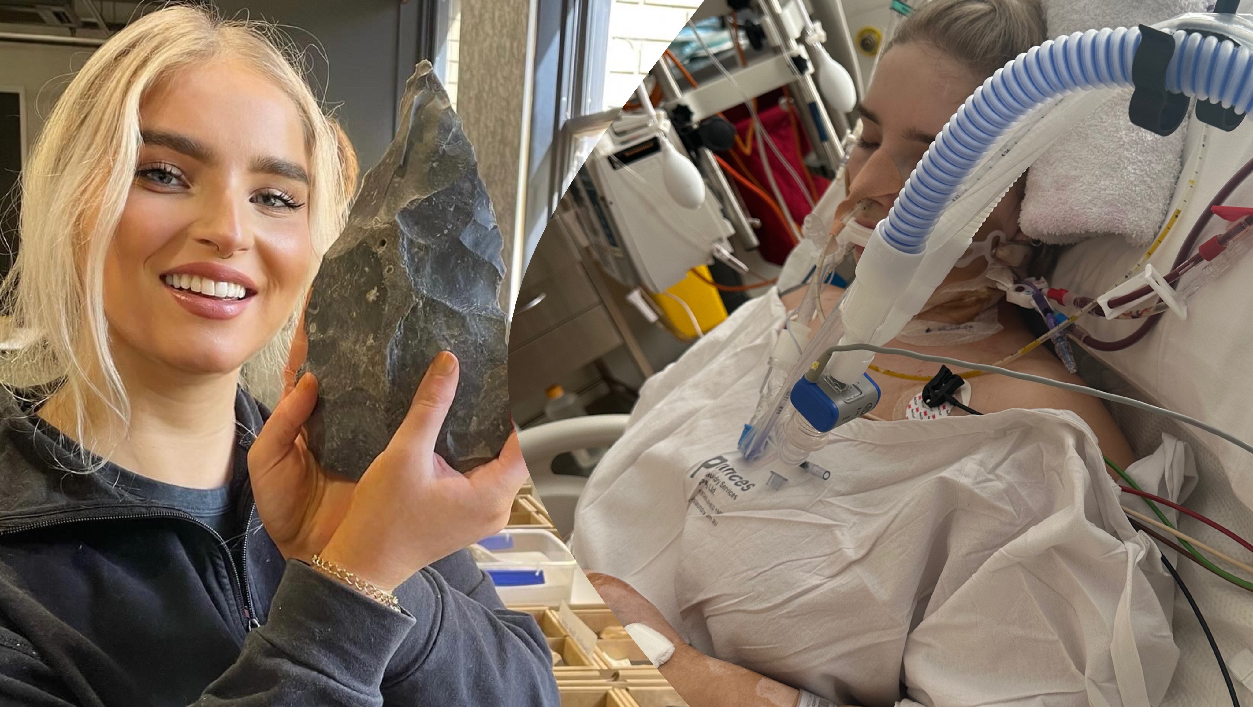 Fundraiser for Cassie Maxfield by Steph Maxfield : Help Cass's recovery ...