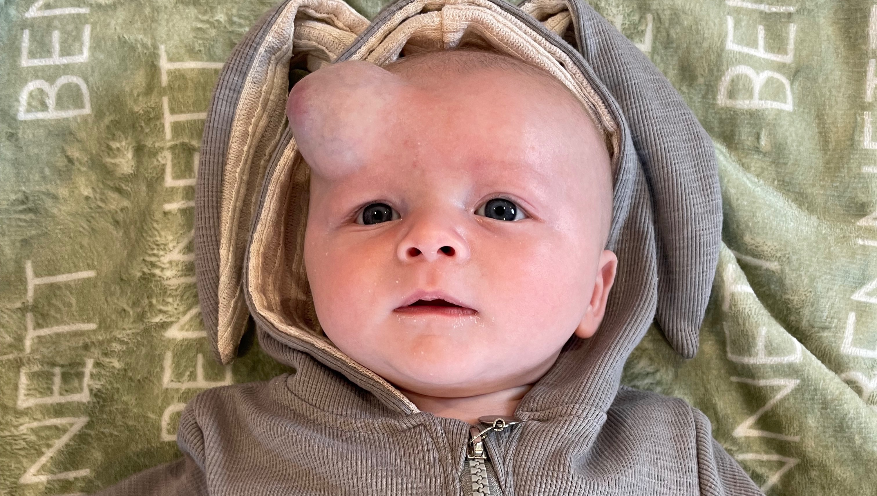 Fundraiser for Kalyn Lewellyn by Amy Houston : Bennett’s Tumor medical ...