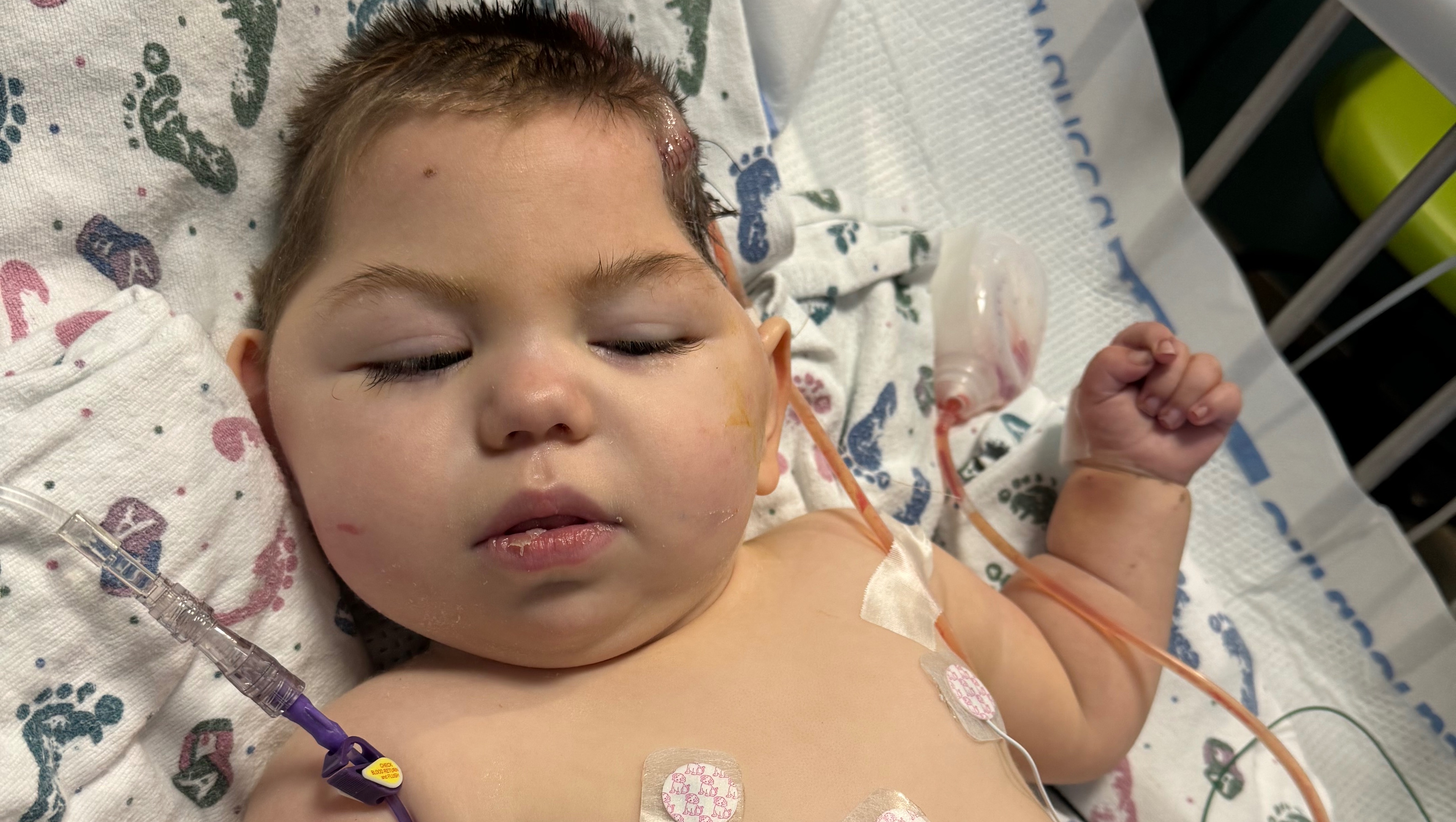 Fundraiser for Bree Coldiron by Elizabeth Postiglione : The Coldiron Family