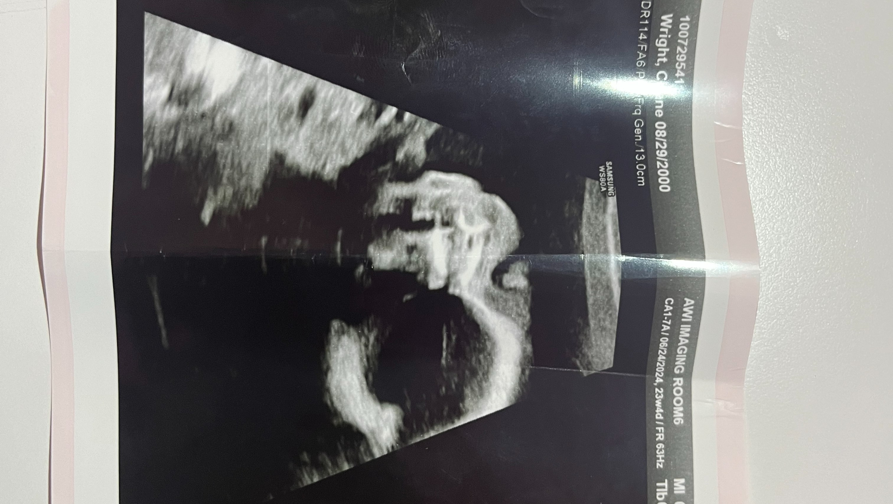 Fundraiser for Chane Wright by Elizabeth Bangura : New Mom, Chyane ...
