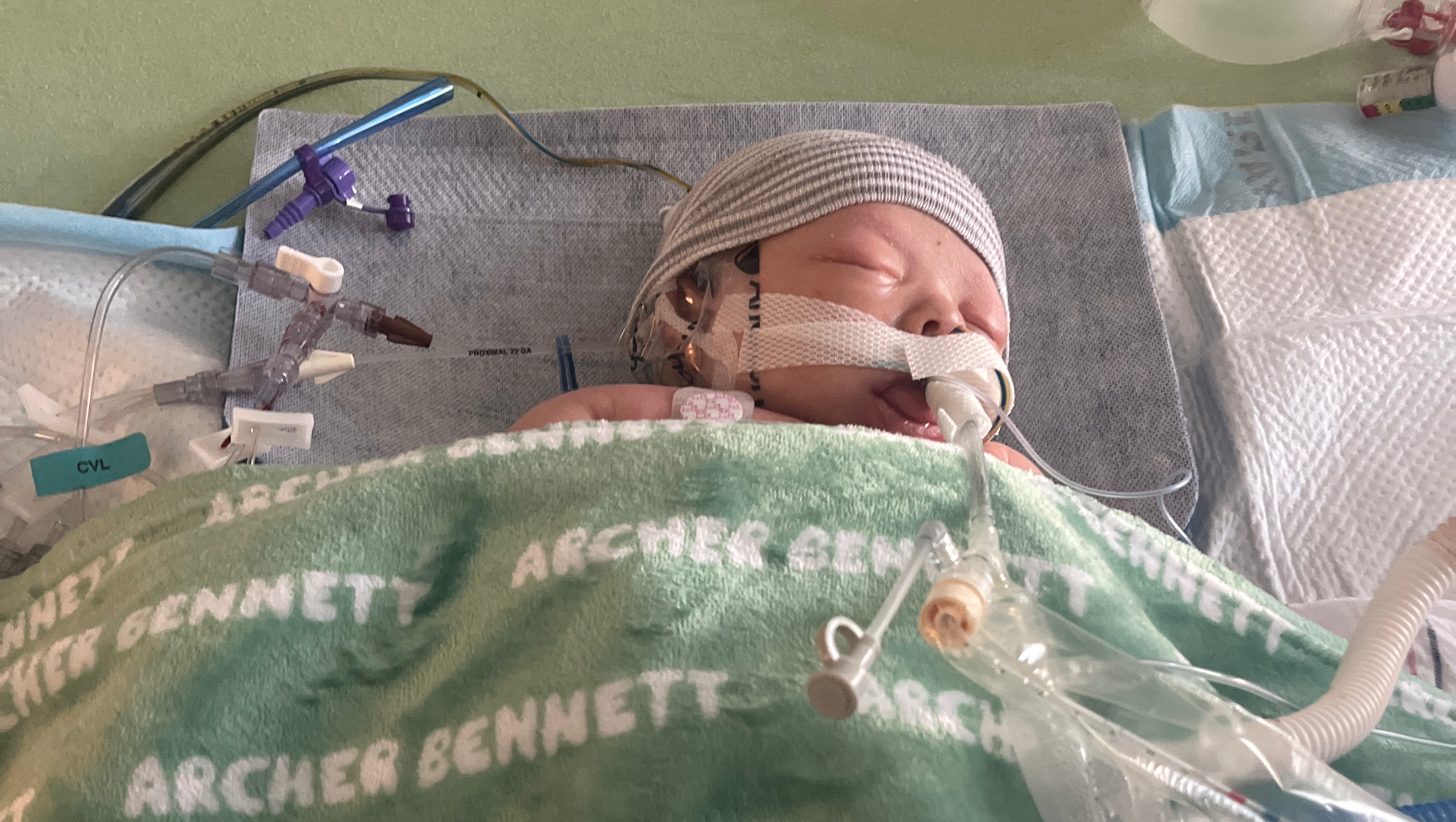 Fundraiser by Timothy Clive : Support Archer's Fight for Life