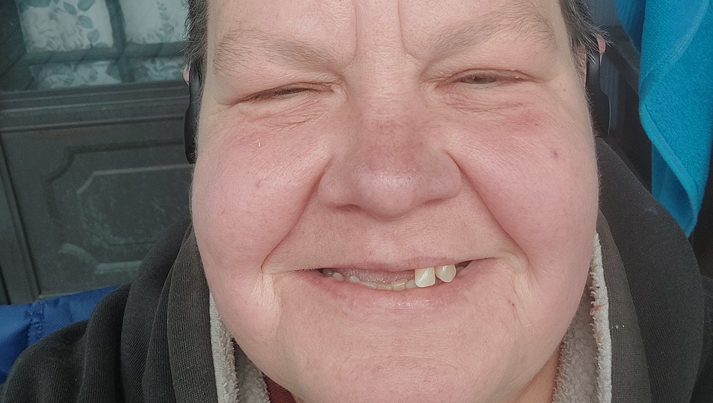 Fundraiser by Jessica Gillman : Jess Needs Teeth