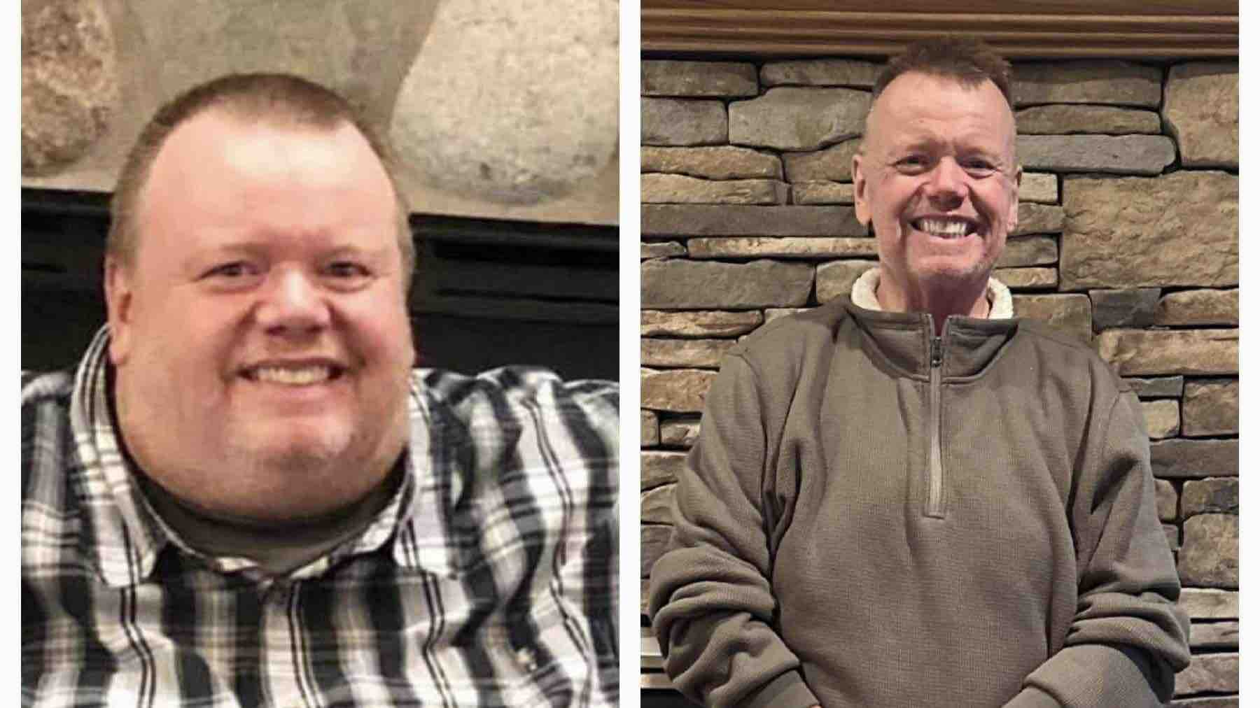 Fundraiser by Stephanie McKinnon : Fund Bob's Life-Changing Skin ...