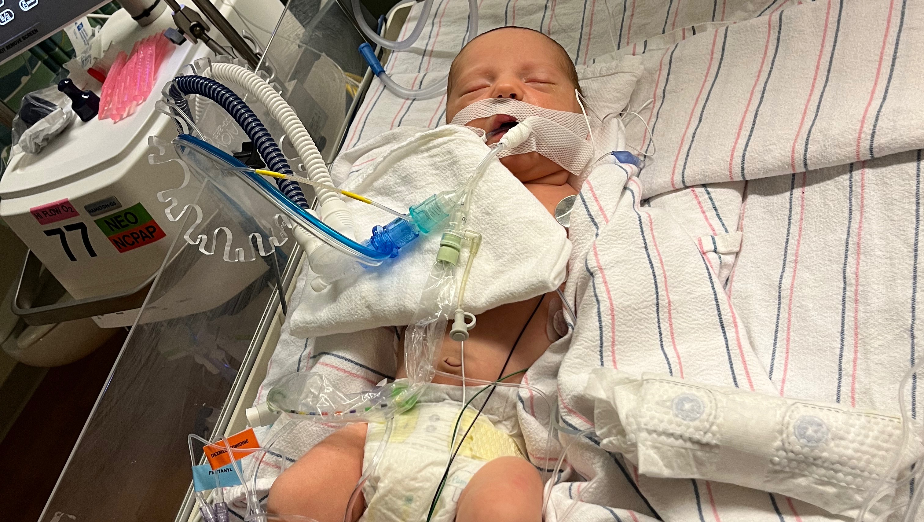 Fundraiser for Chandler Gohn by Pilar Tobin : Medical Funds for Gohn Family