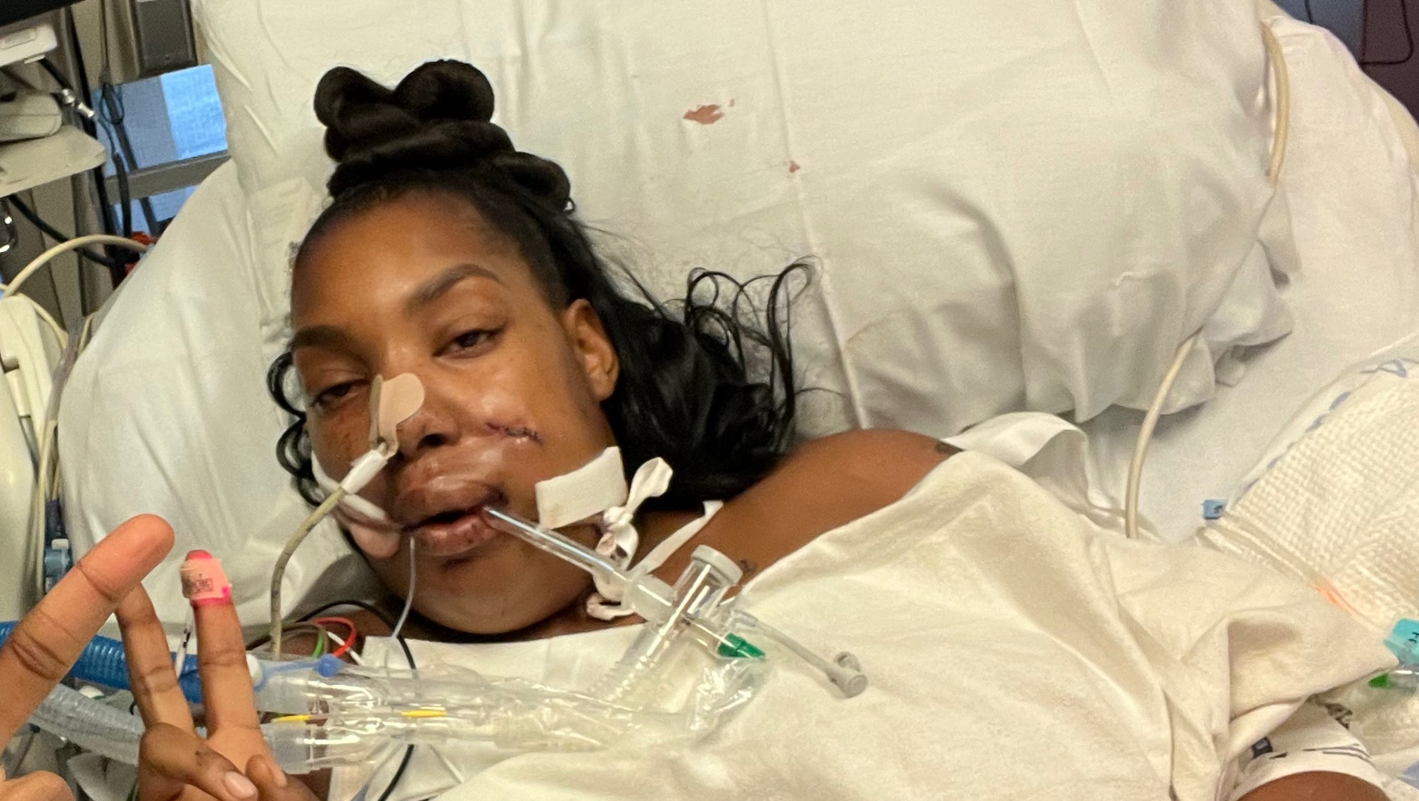 Fundraiser for Brenae Smith by Donique Mosley : Stand with Brenae: Aid Her Road to Recovery