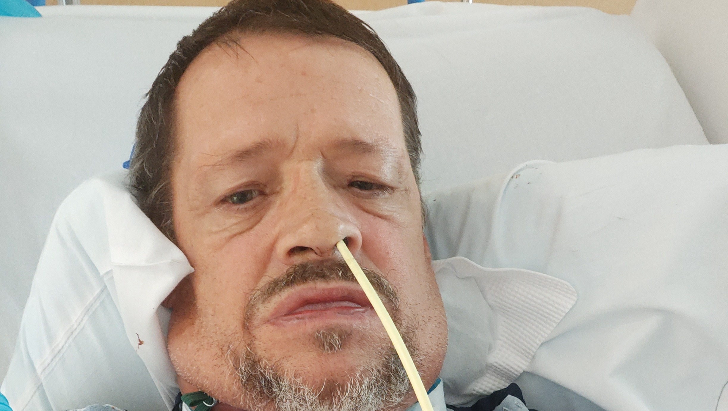 Fundraiser by Randy Fansler : Join Randy's Fight Against SCC of Larynx