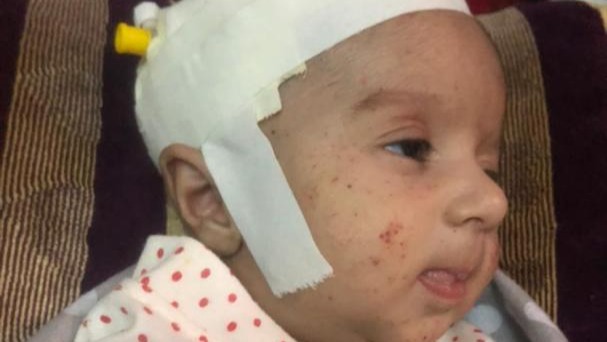 Fundraiser by Safatullah Badar : Urgent help for Subia's Bone Marrow ...