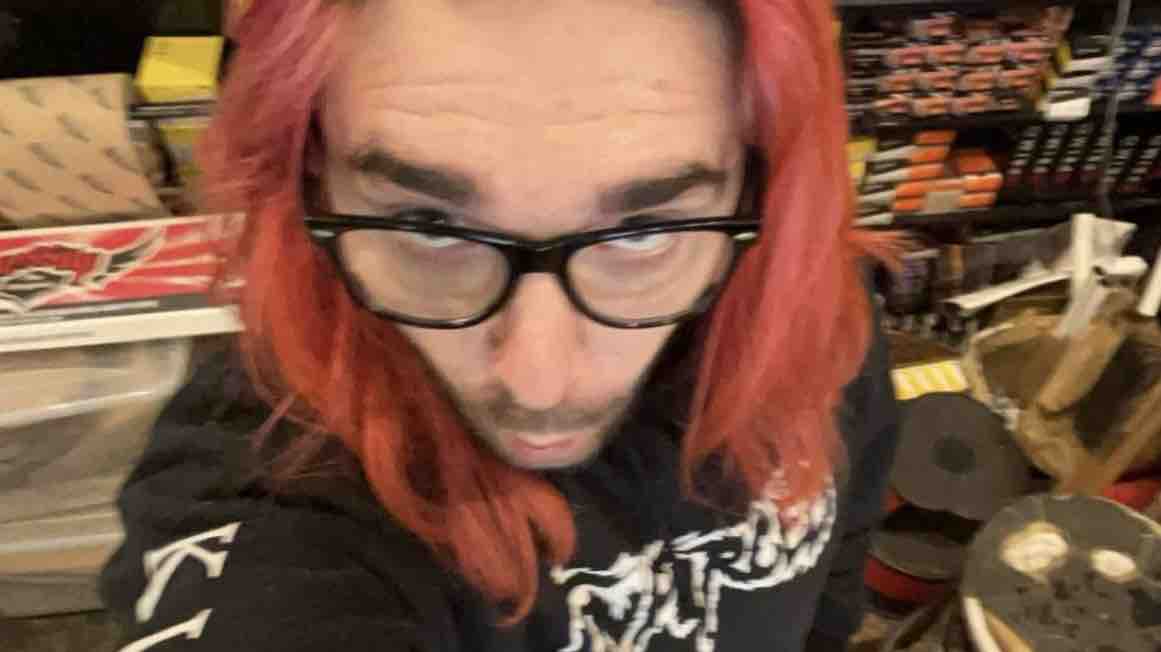 Fundraiser by Aaron Johnson : Help Aaron fix his teeth!!!