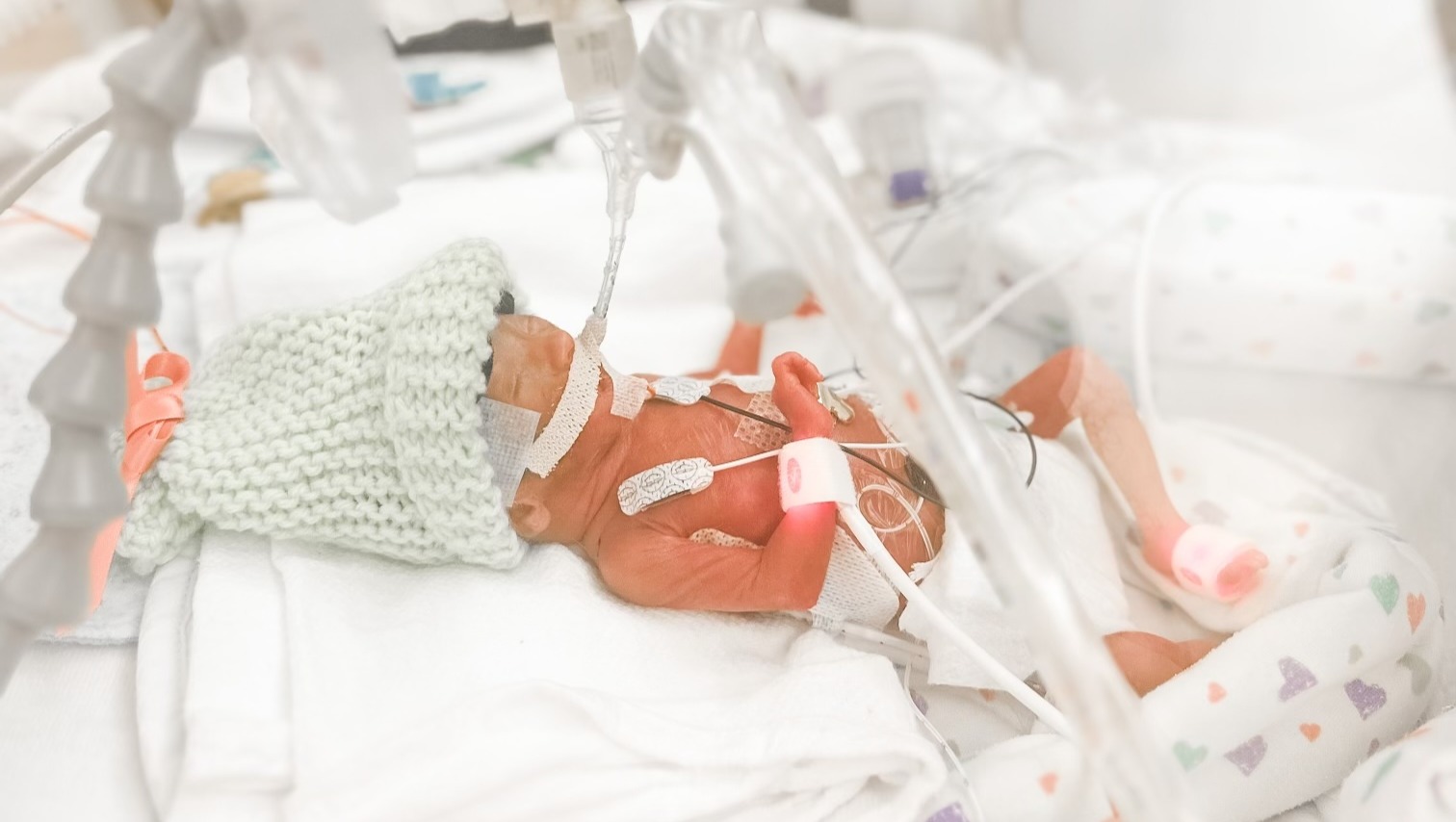 Fundraiser for Mercedes McLaughlin by Deborah Cook : Sophie Bella's Story: Lighting her Path to ...