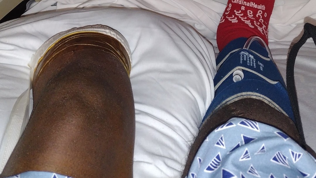 Fundraiser by Jimmy Watson : Jimmy's Journey: From Sepsis to Recovery