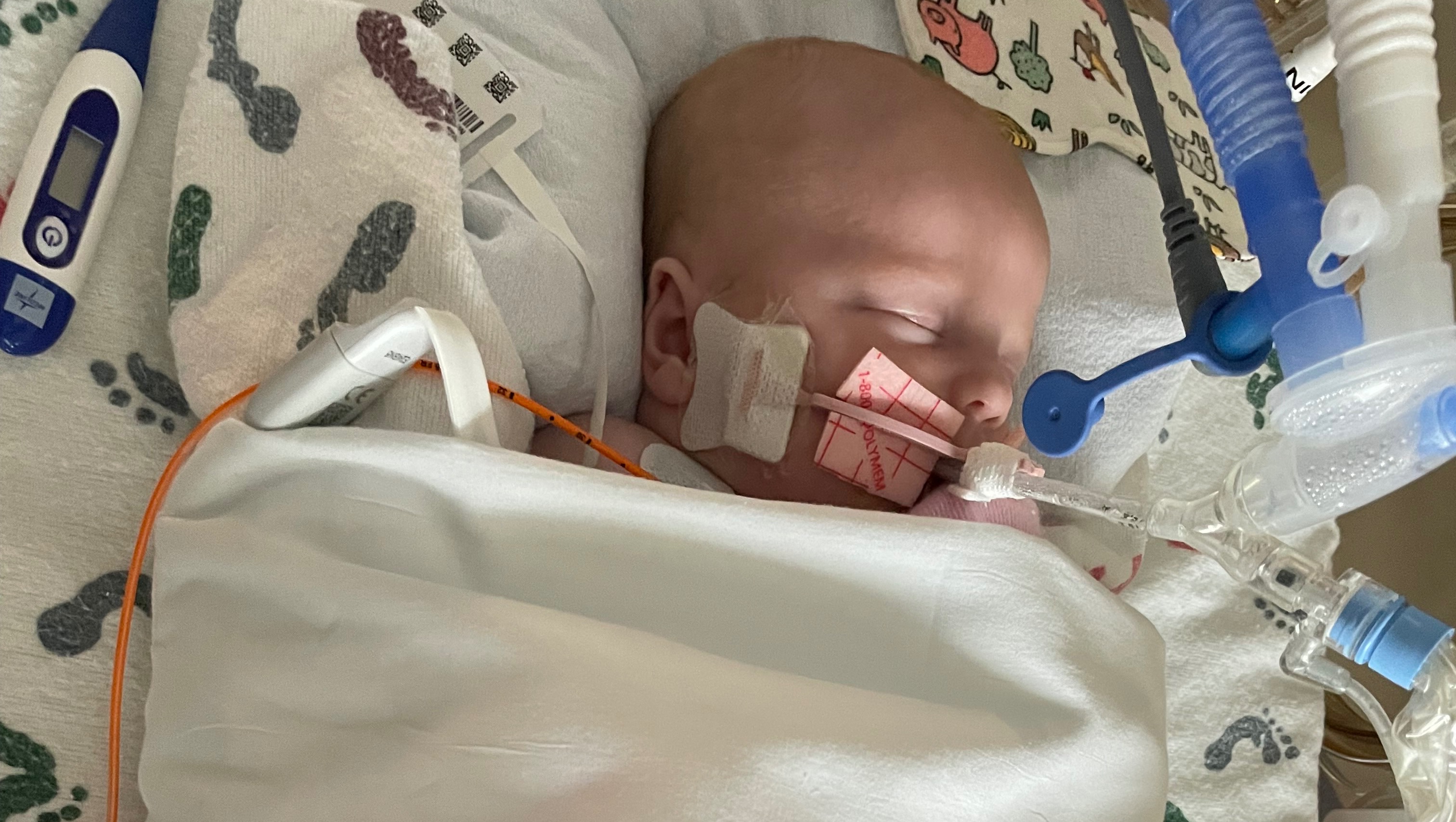 Fundraiser by Heidi Smith : Support Heidi and Nathan's Baby Girl's CDH ...