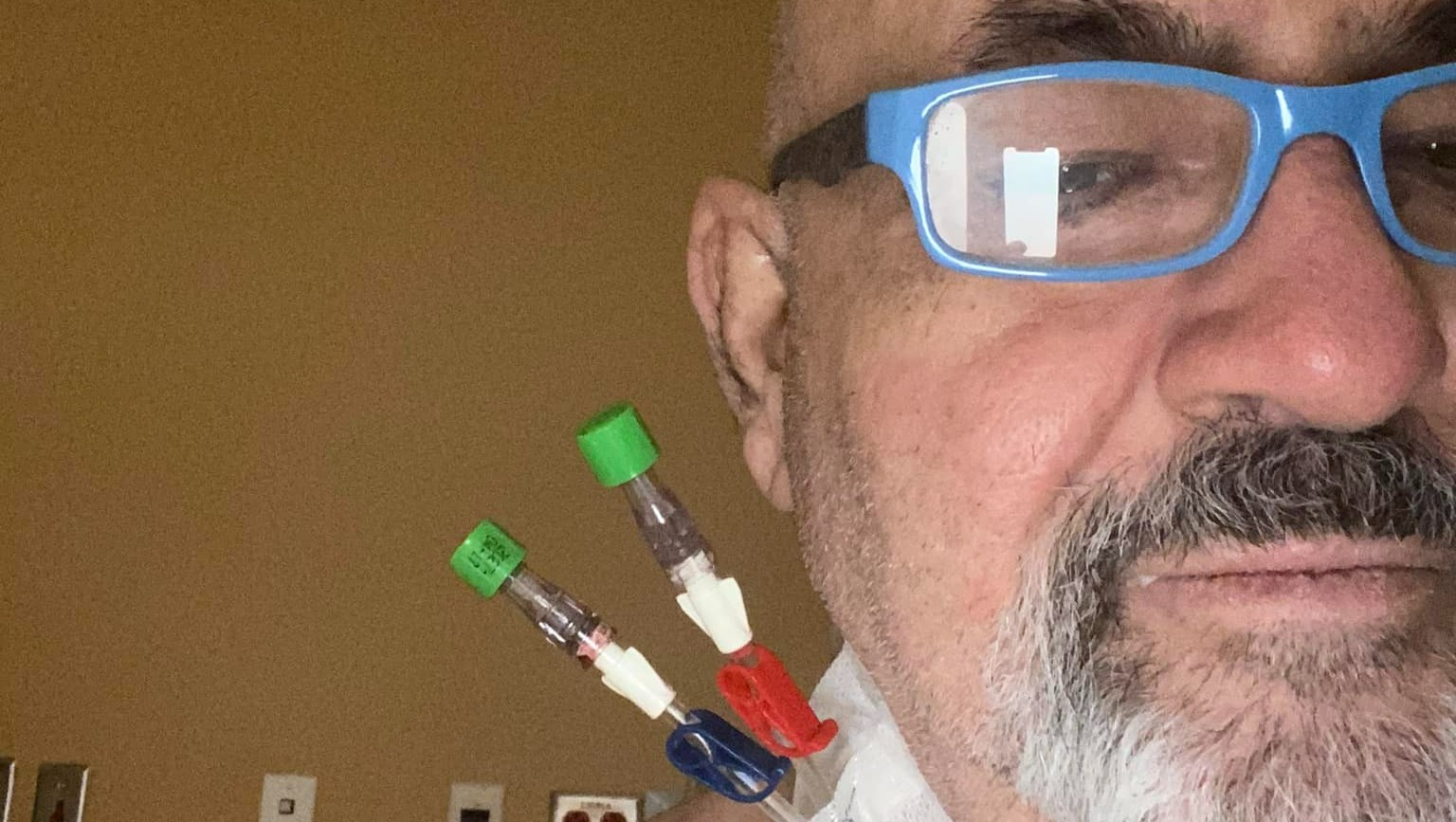Fundraiser by Joel Jadofsky : Support Joel's Fight Against B Cell Lymphoma