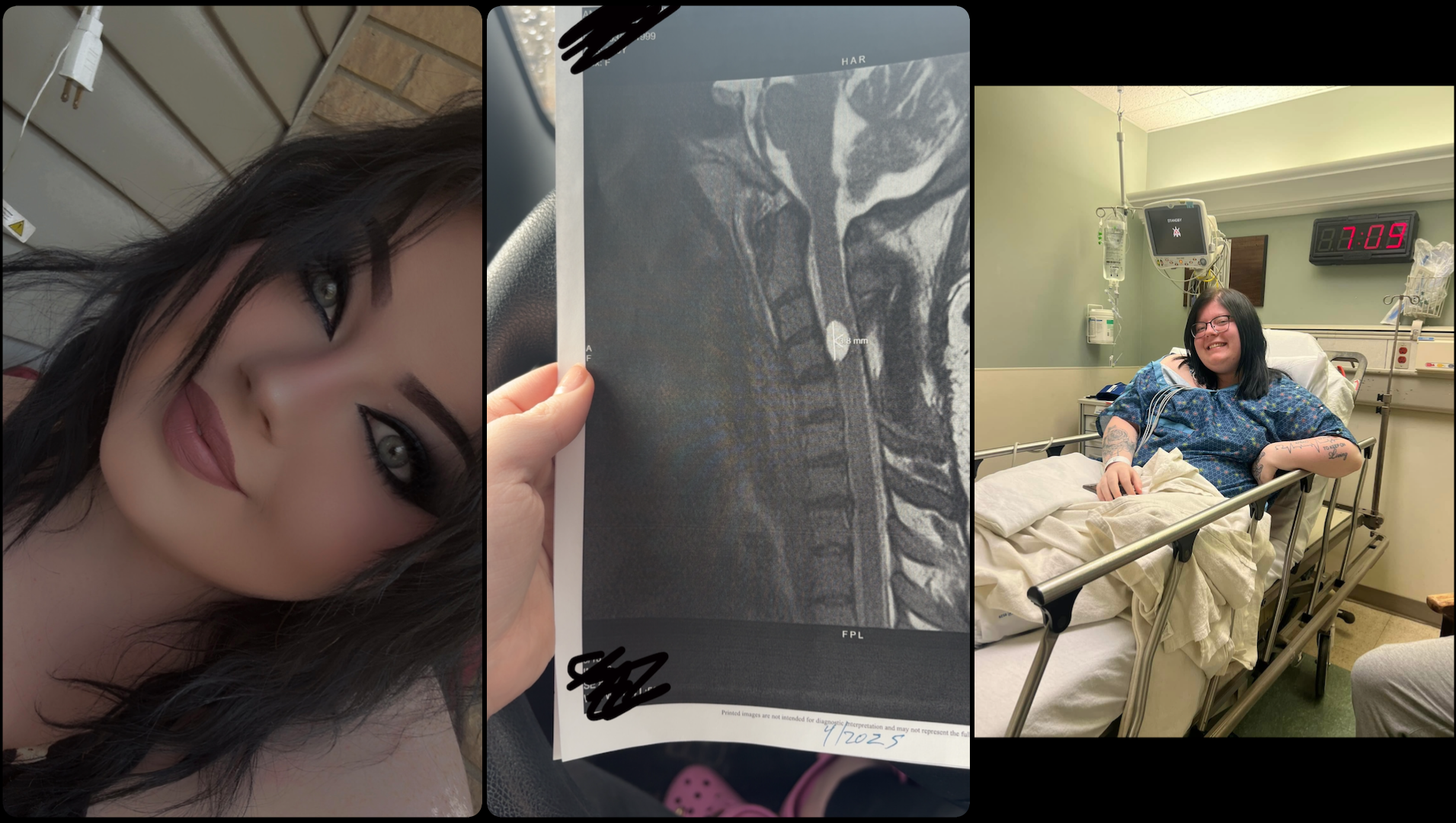 Fundraiser by Amanda Packard : Support Amandas battle with a spinal ...