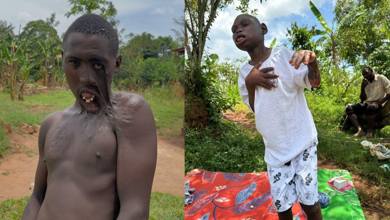 Fundraiser by Robert Kiberu : HELP TO CATER FOR ALEX AND BENARD'S SURGERY
