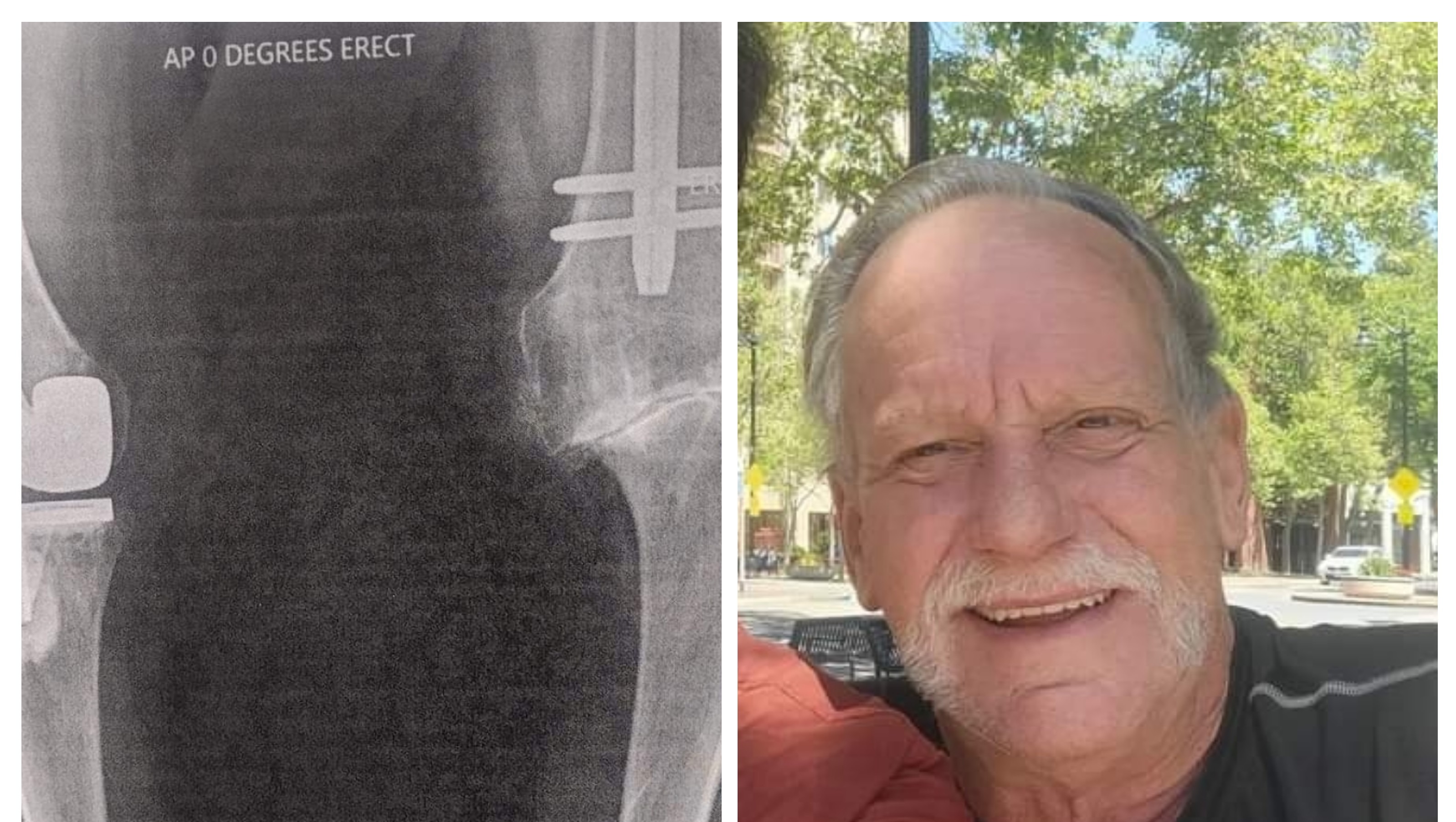 Fundraiser by Robert Clevidence : Help Ease Lance's Journey to Healing